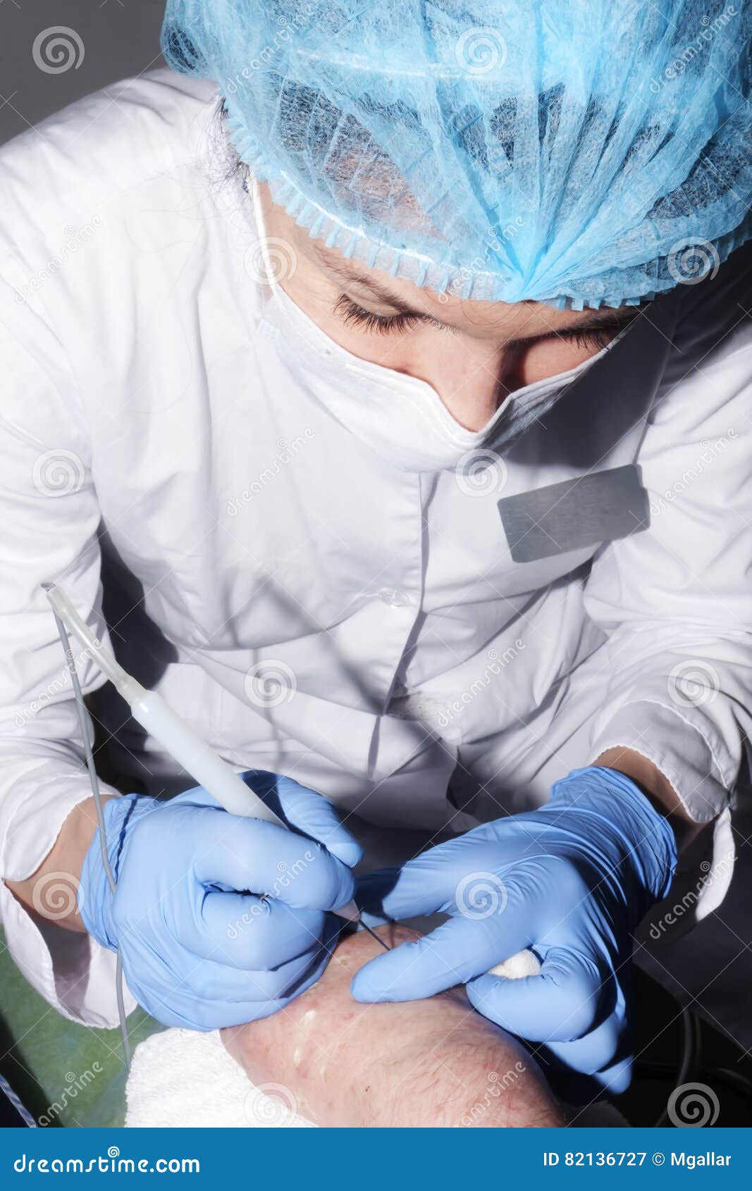 Microsurgery : Doctor Remove Skin Disease Stock Image - Image of ...