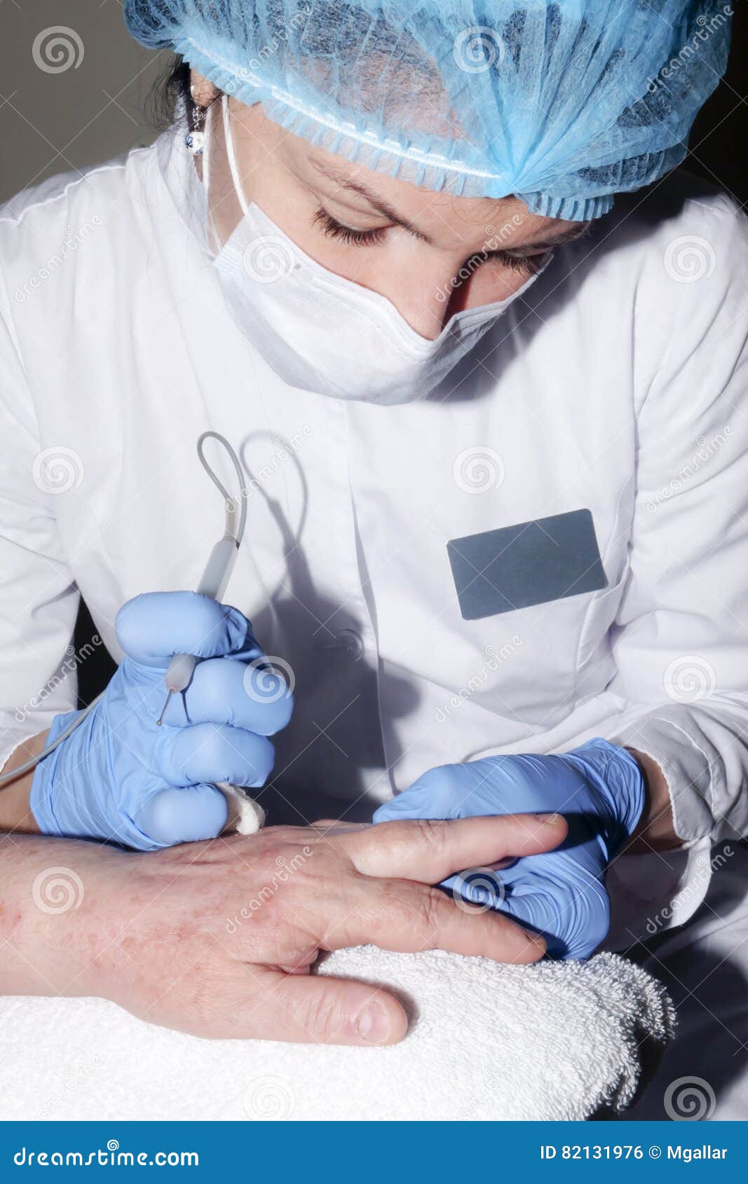 Microsurgery : Doctor Removes Skin Disease Stock Photo - Image of ...