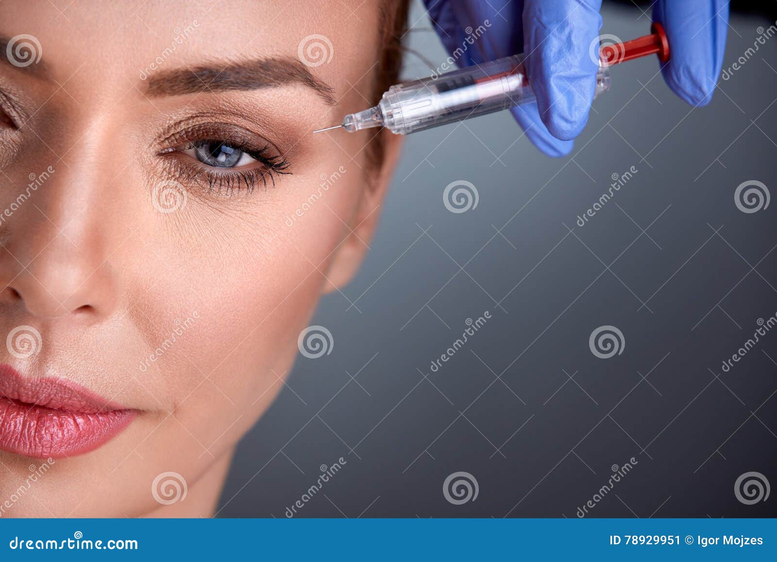 Middle Age Woman on Rejuvenation Therapy Stock Image - Image of aging ...