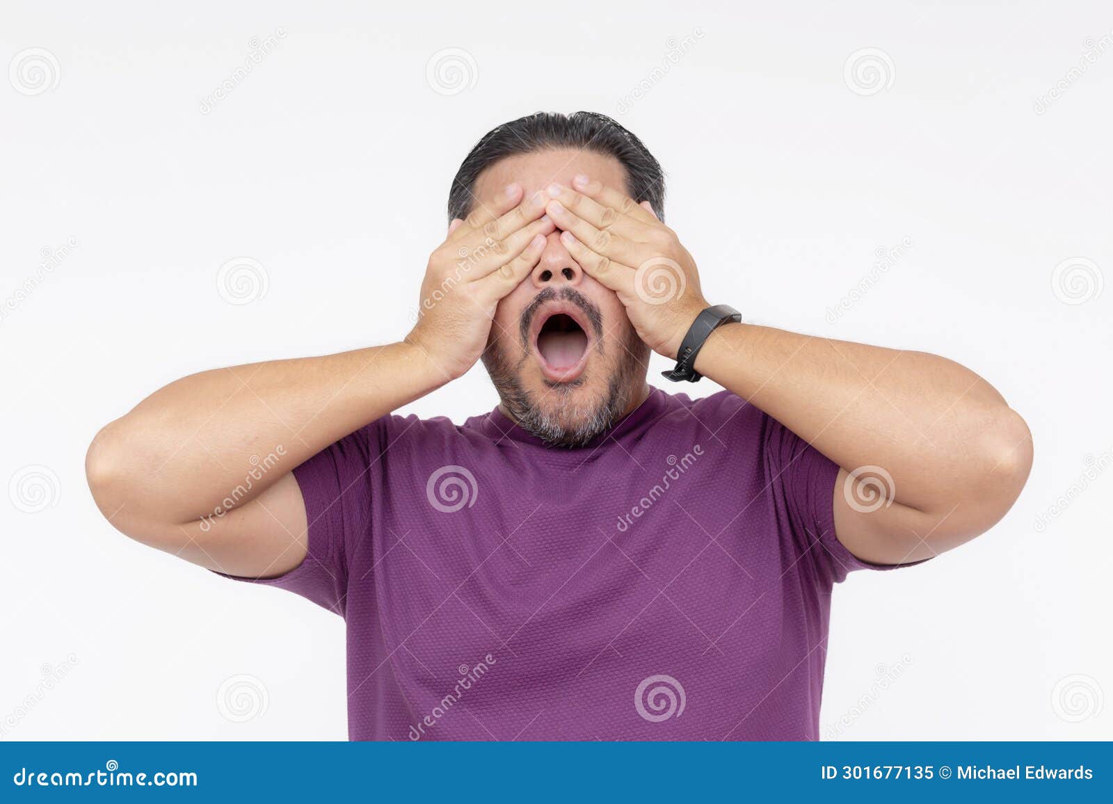 A Middle Aged Guy Covering His Eyes with Both Hands after Being Blinded ...