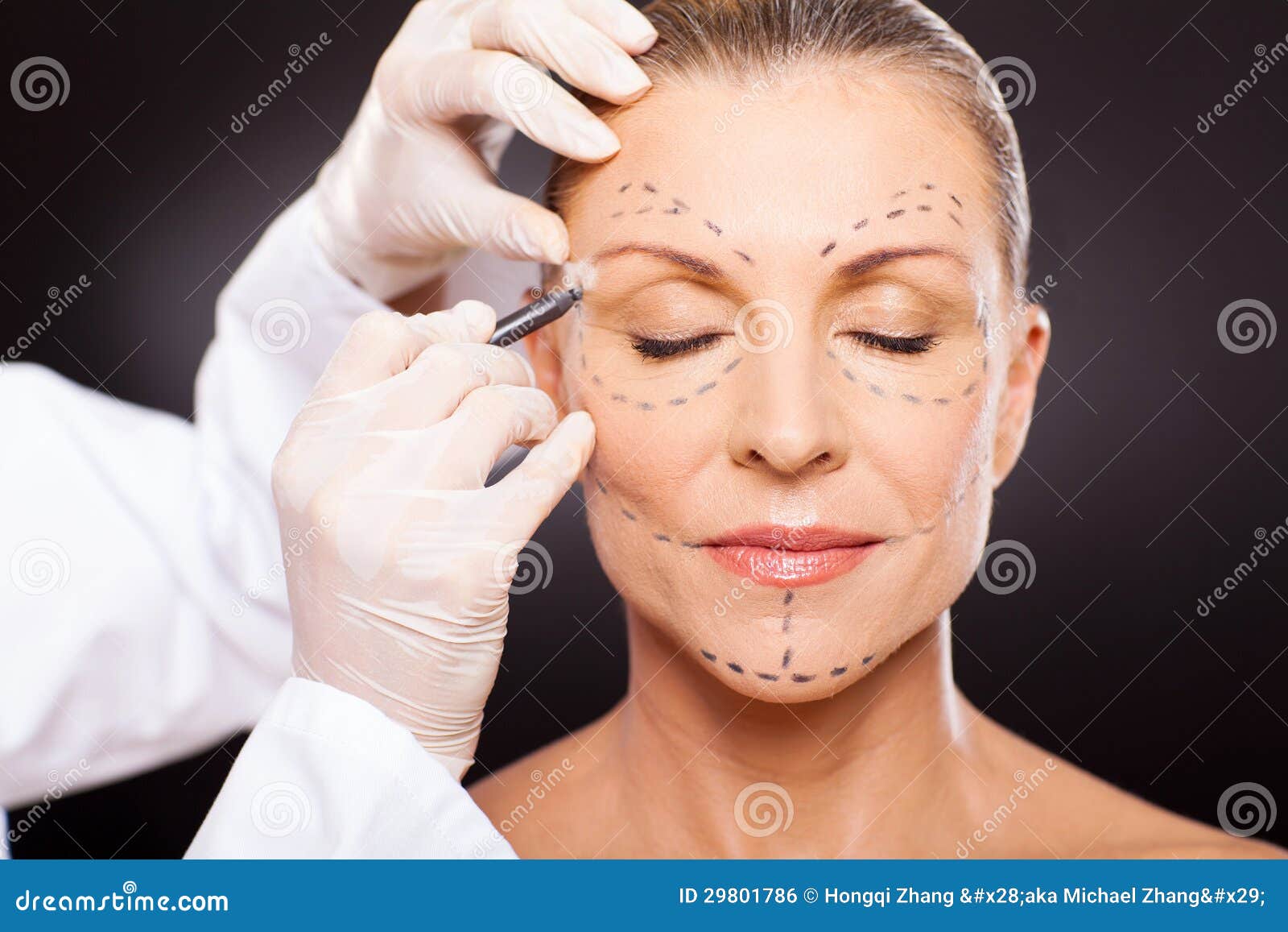 Middle Aged Plastic Surgery Stock Photo - Image of care, beautician ...