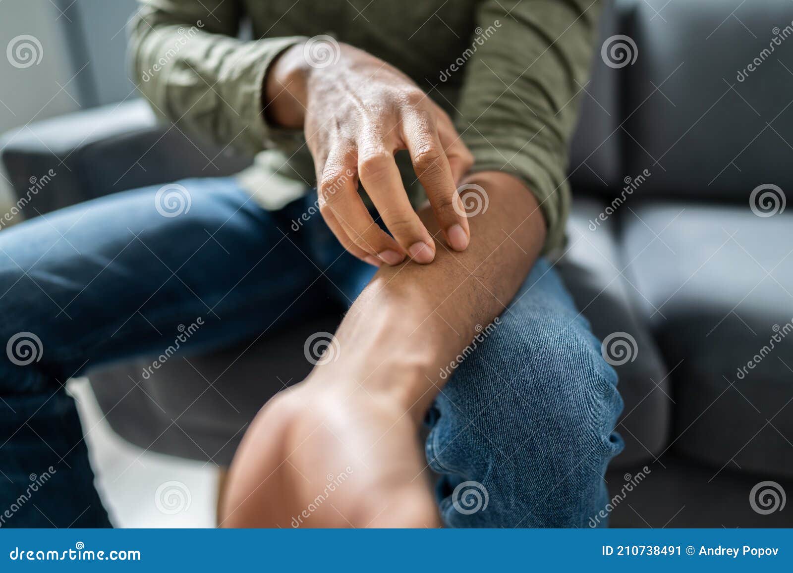 Close-up of an Man Scratching His Hand Stock Image - Image of medical ...