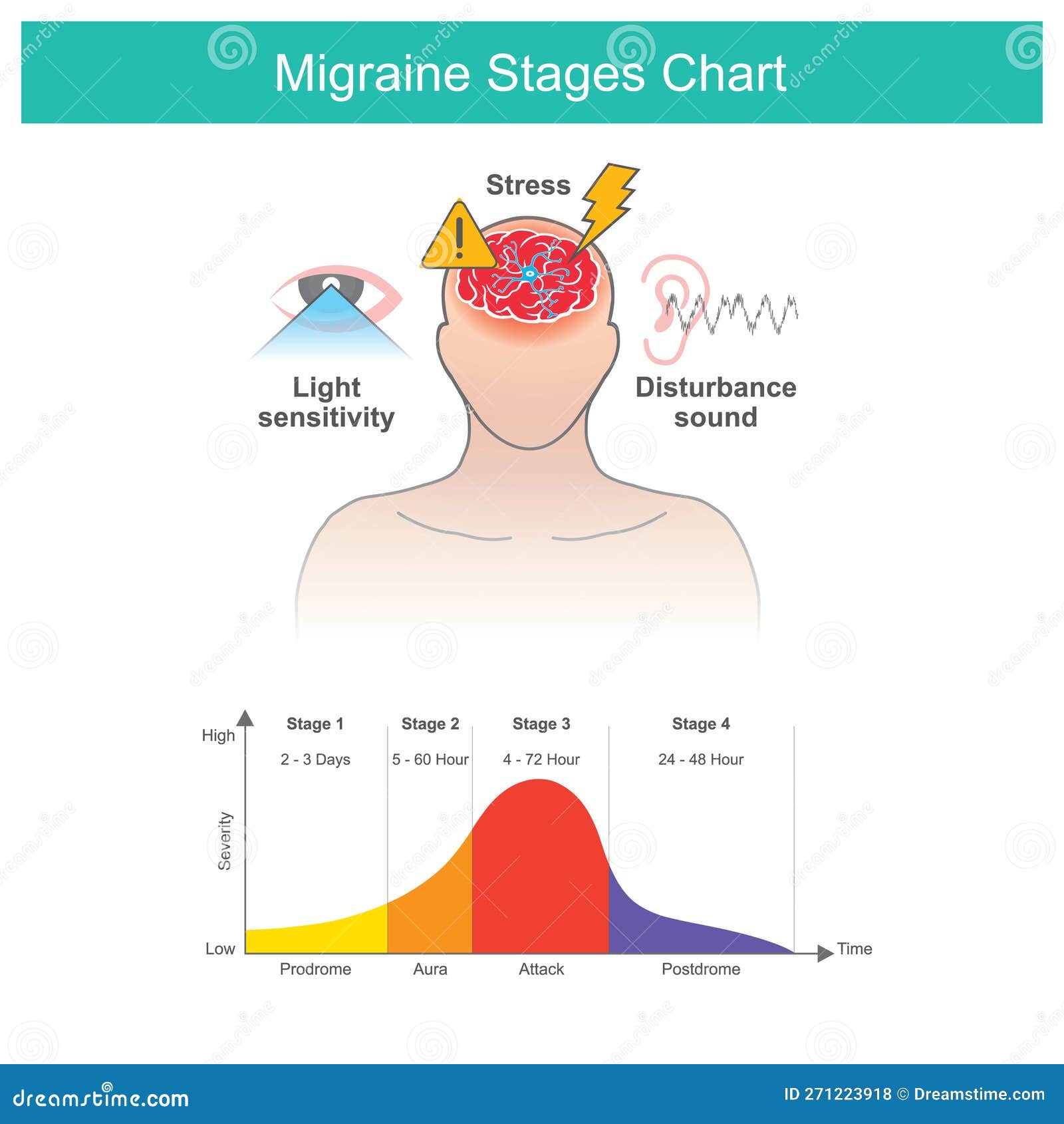 Migraines Stages Chart Migraines Stages Chart And A Factors Cause Of