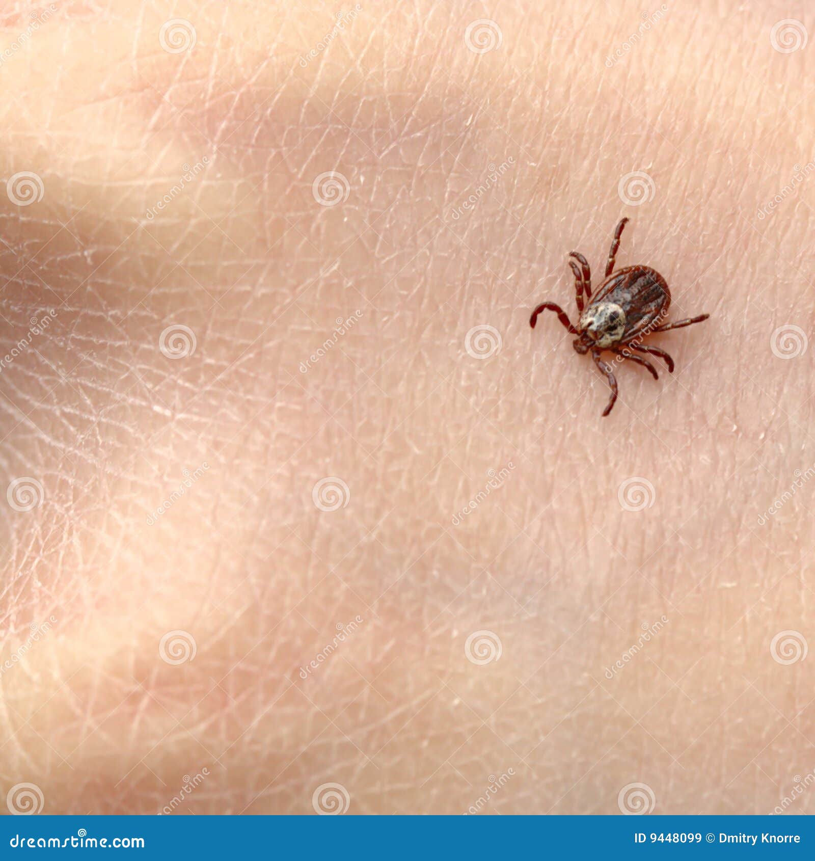 Mijt stock afbeelding. Image of geleedpotige, niemand - 9448099