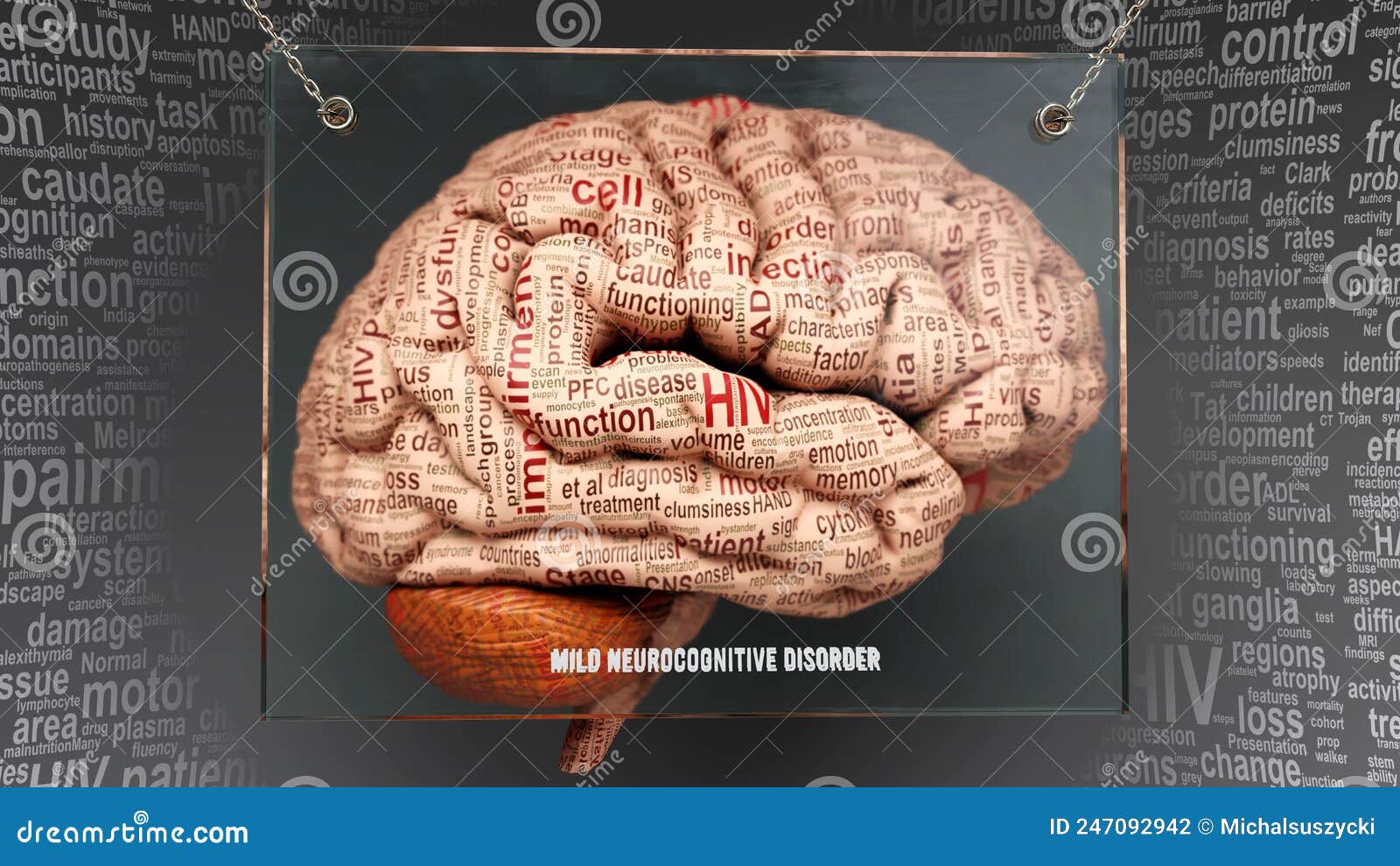 Mild Neurocognitive Disorder in Human Brain Stock Illustration ...