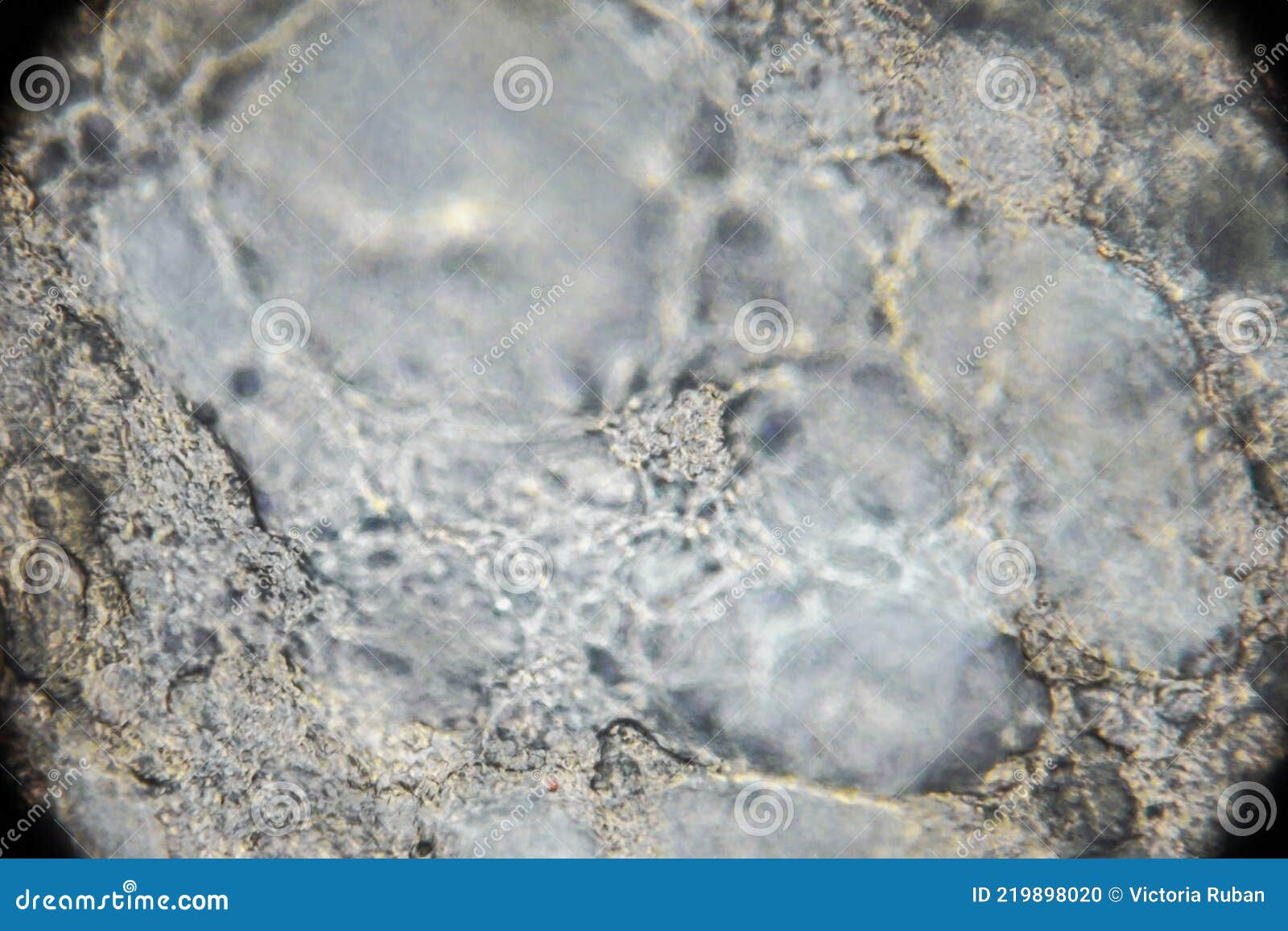 Milk Sausage Texture Under a Light Microscope Stock Photo - Image of ...