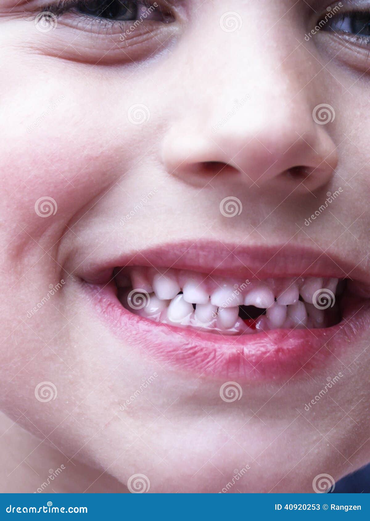 Milkteeth stock image. Image of healthy, development - 40920253