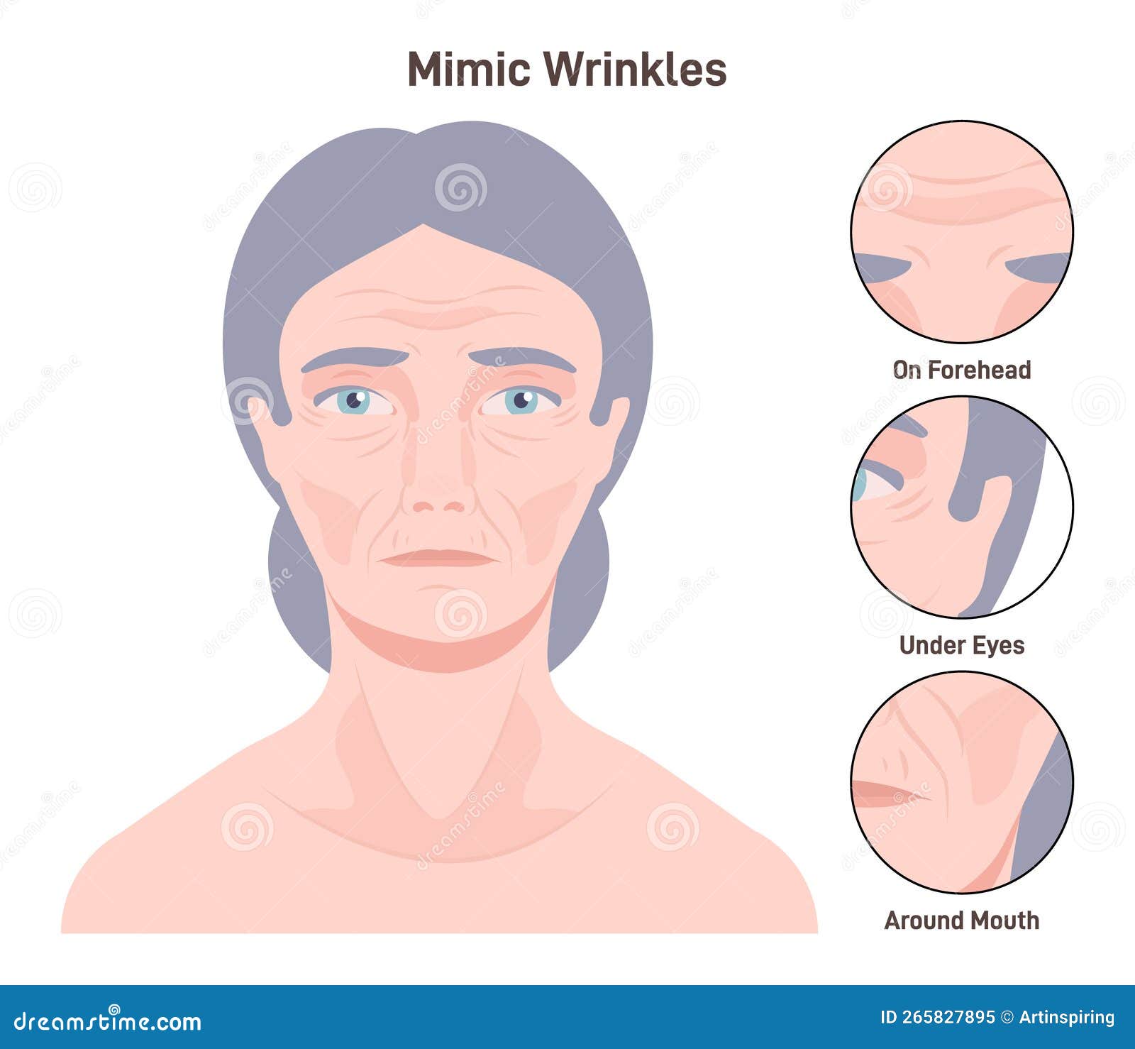 Wrinkles On The Forehead. Rejuvenation. Plastic Surgery Cartoon Vector ...