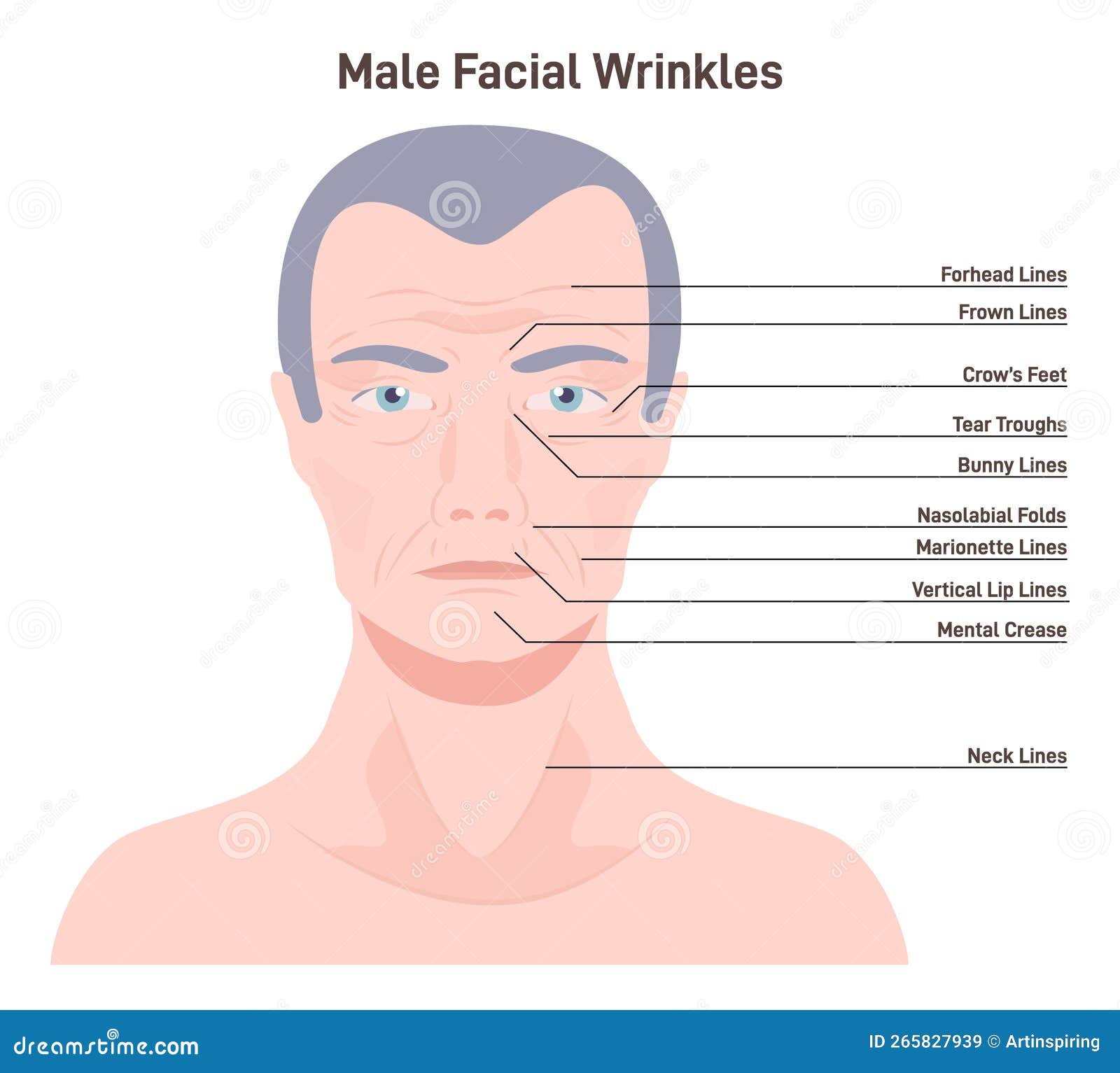 Wrinkles On The Forehead. Rejuvenation. Plastic Surgery Cartoon Vector ...