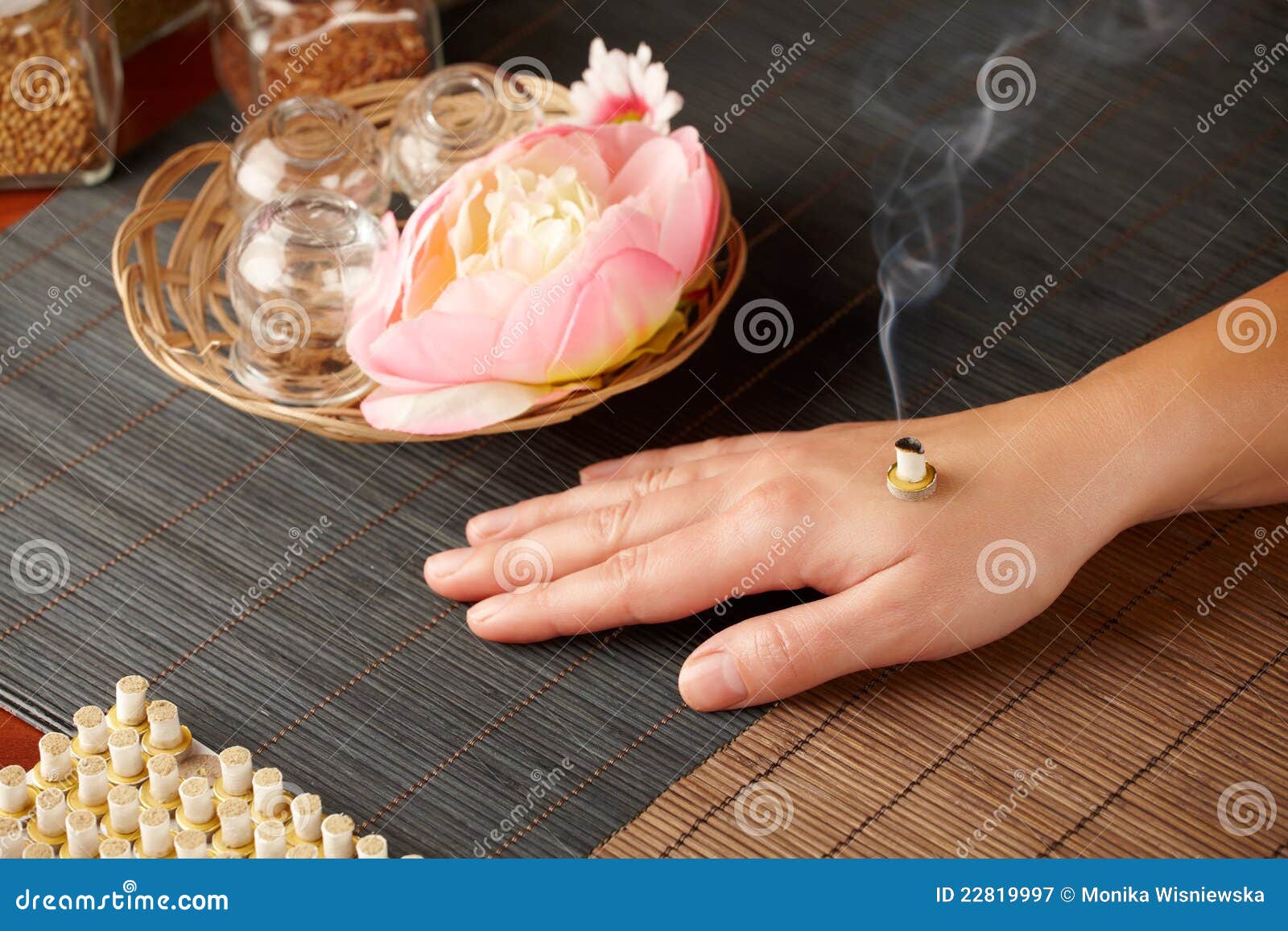 Mini moxa stick therapy stock image. Image of care, acupuncture - 22819997