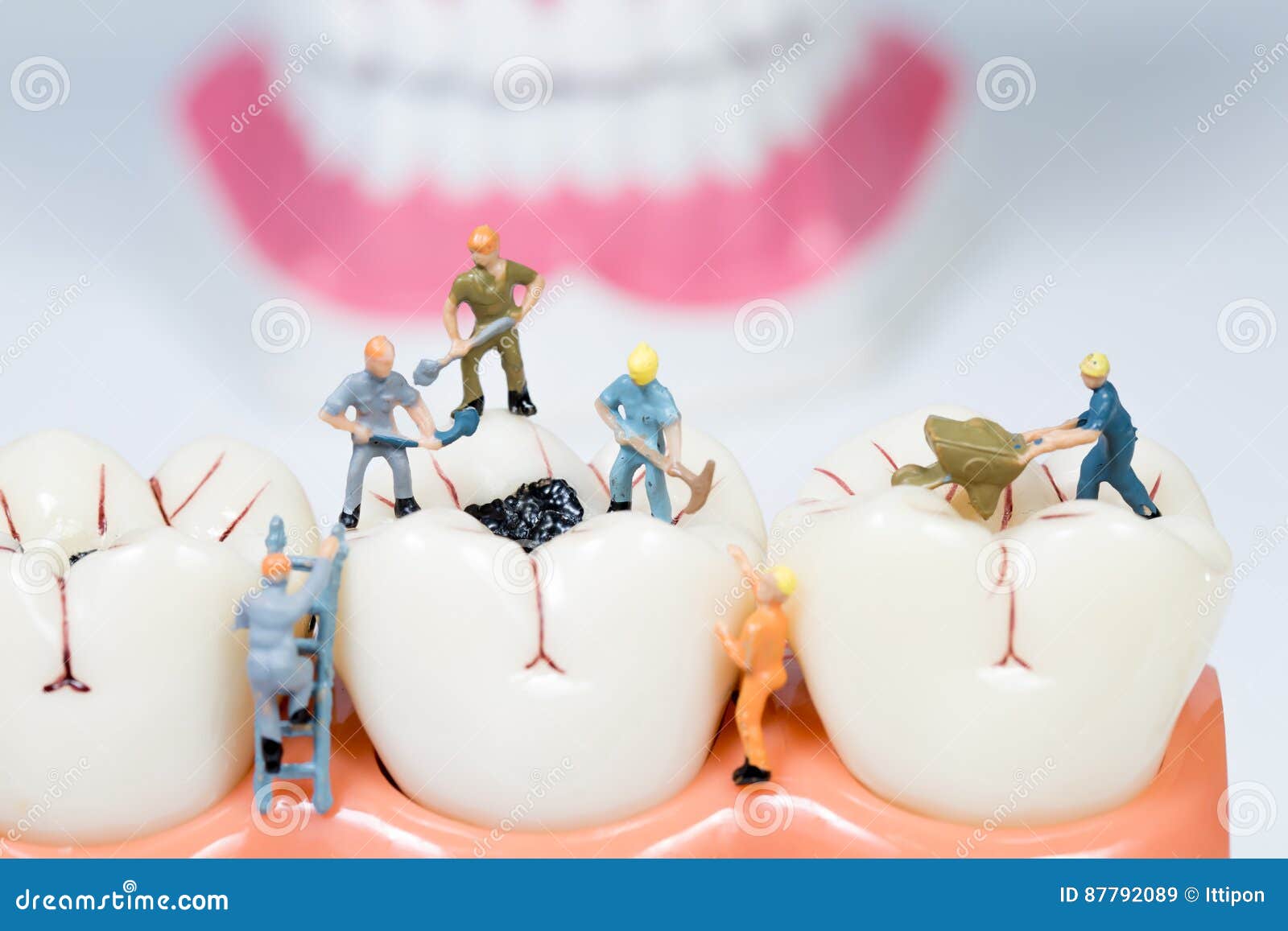 Miniature People Clean Tooth Model Stock Image - Image of tool ...