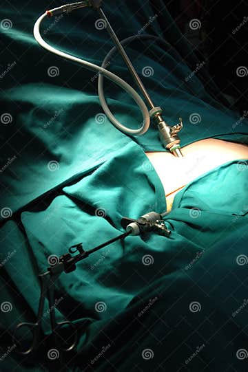 Minimally invasive surgery stock photo. Image of minimally - 1156822