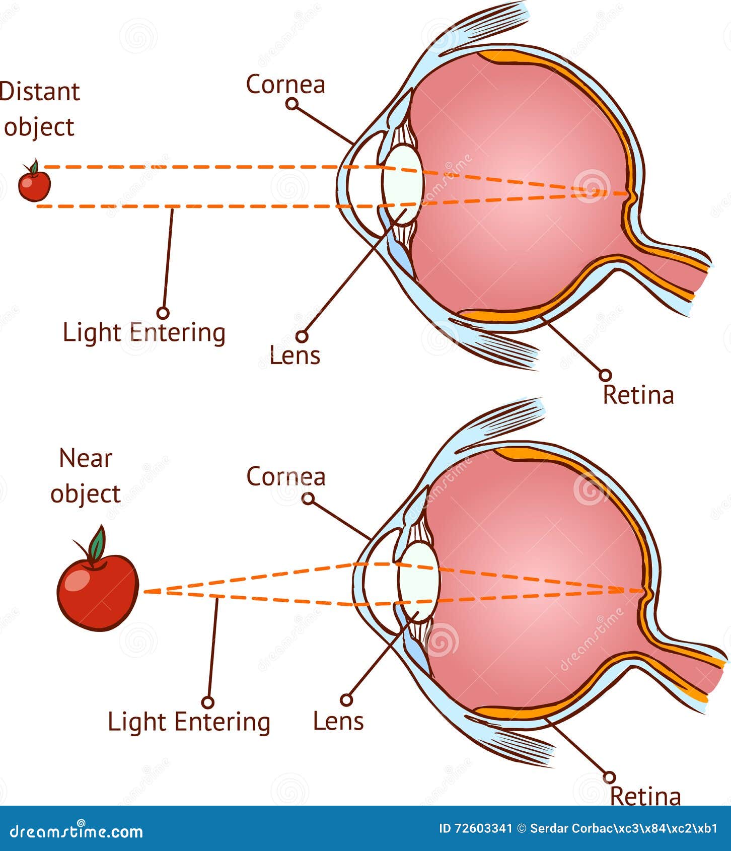 Miopía y visión normal ilustración del vector. Ilustración de arte ...