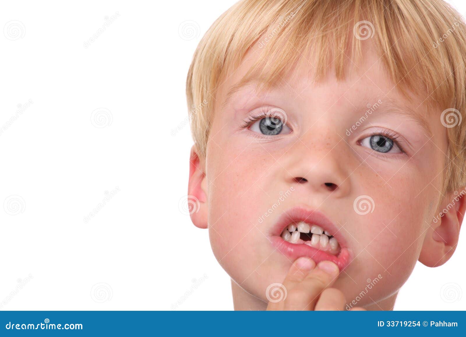 Missing teeth stock photo. Image of lifestyle, growing - 33719254