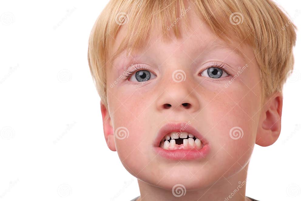 Missing teeth stock photo. Image of lifestyle, cute, posing - 33719284