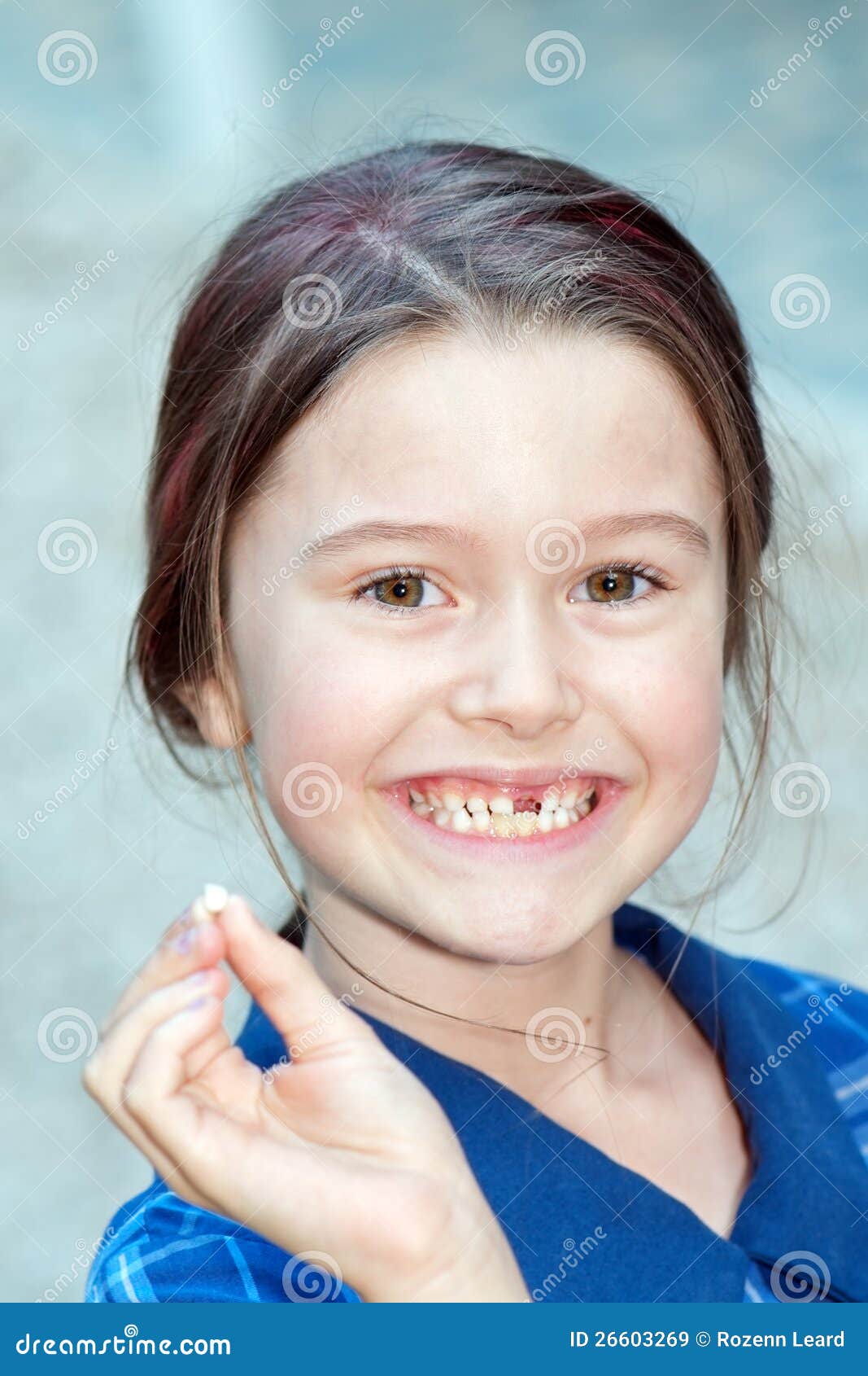 Missing tooth stock image. Image of caucasian, little - 26603269