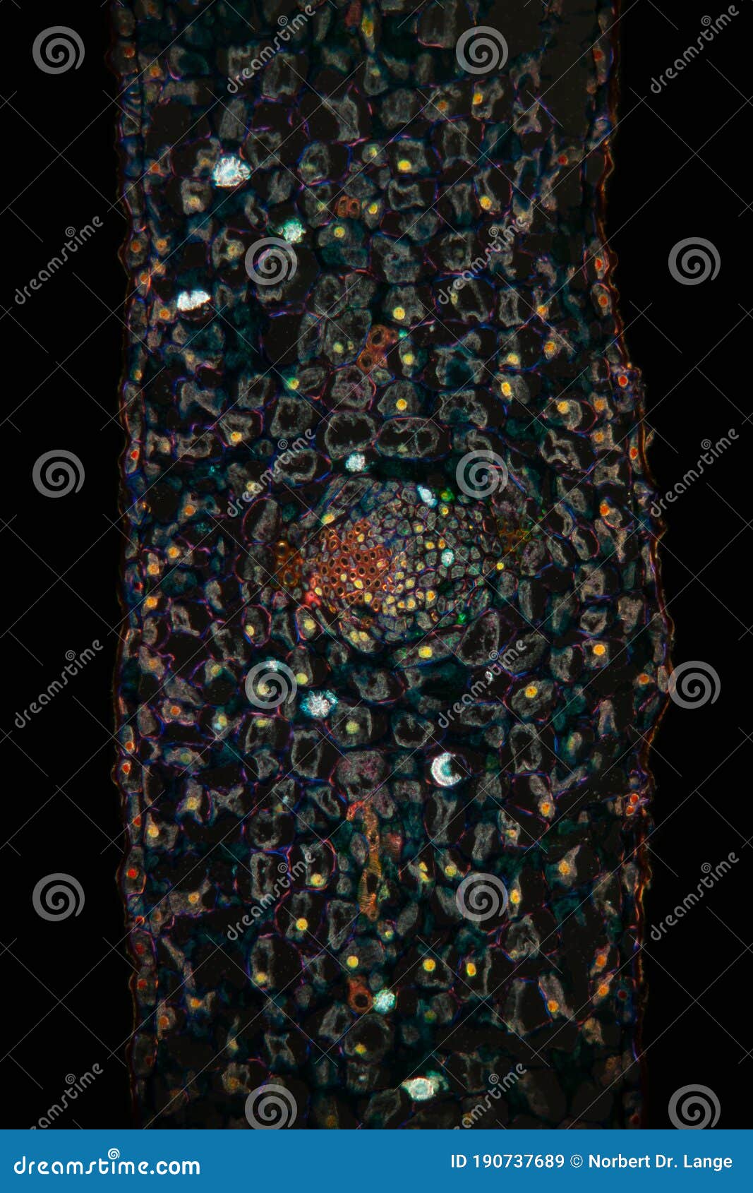 Mistletoe Cross-section in the Dark Field Stock Image - Image of ...