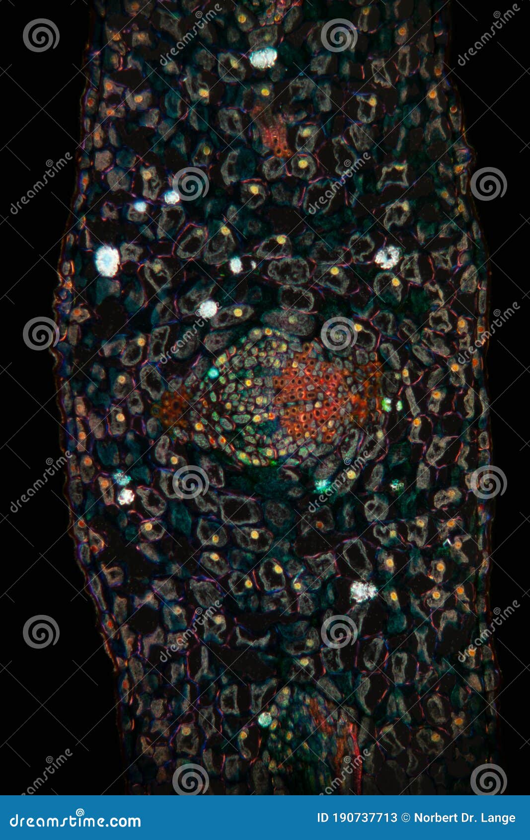 Mistletoe Cross-section in the Dark Field Stock Image - Image of ...