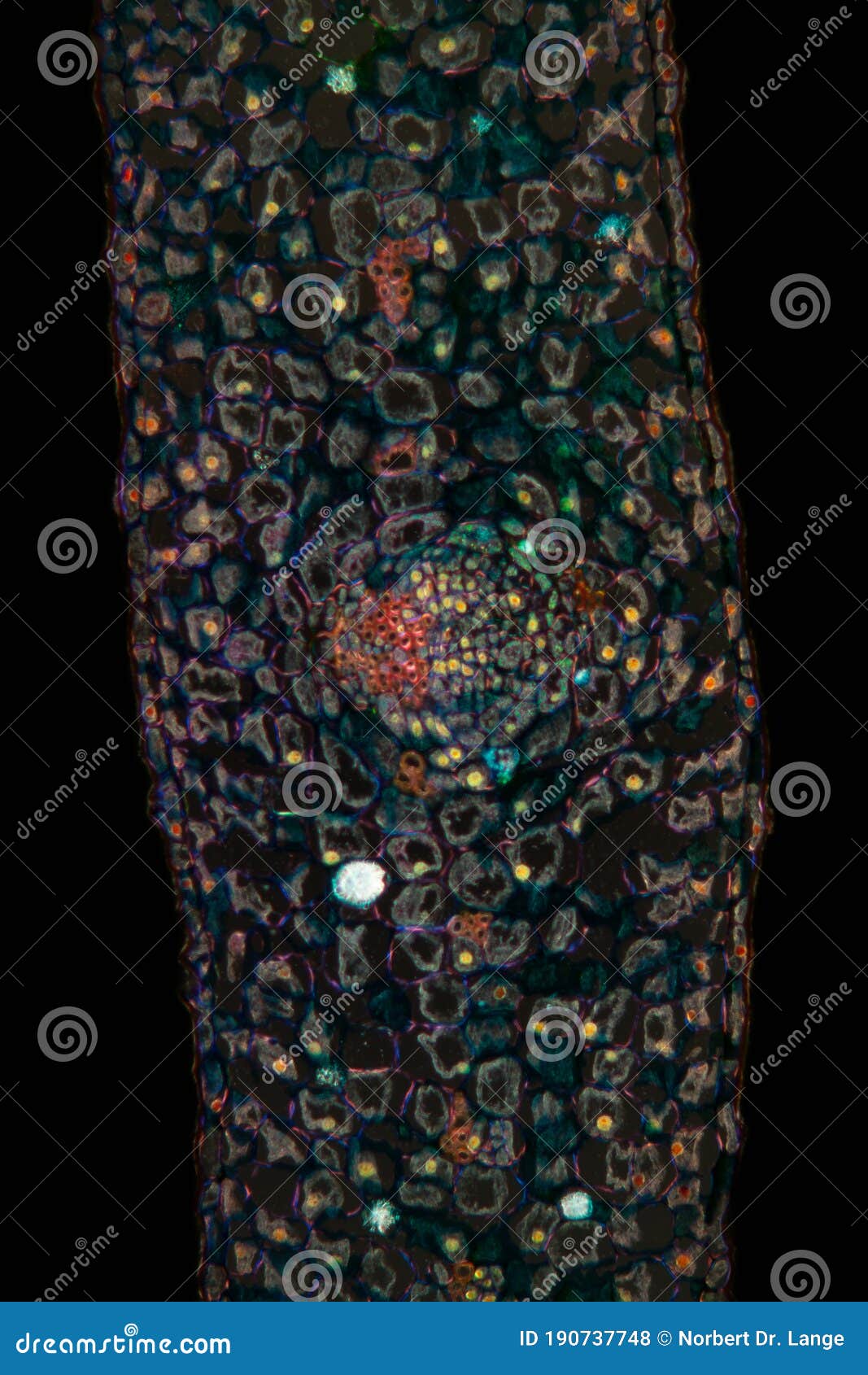 Mistletoe Cross-section in the Dark Field Stock Photo - Image of black ...