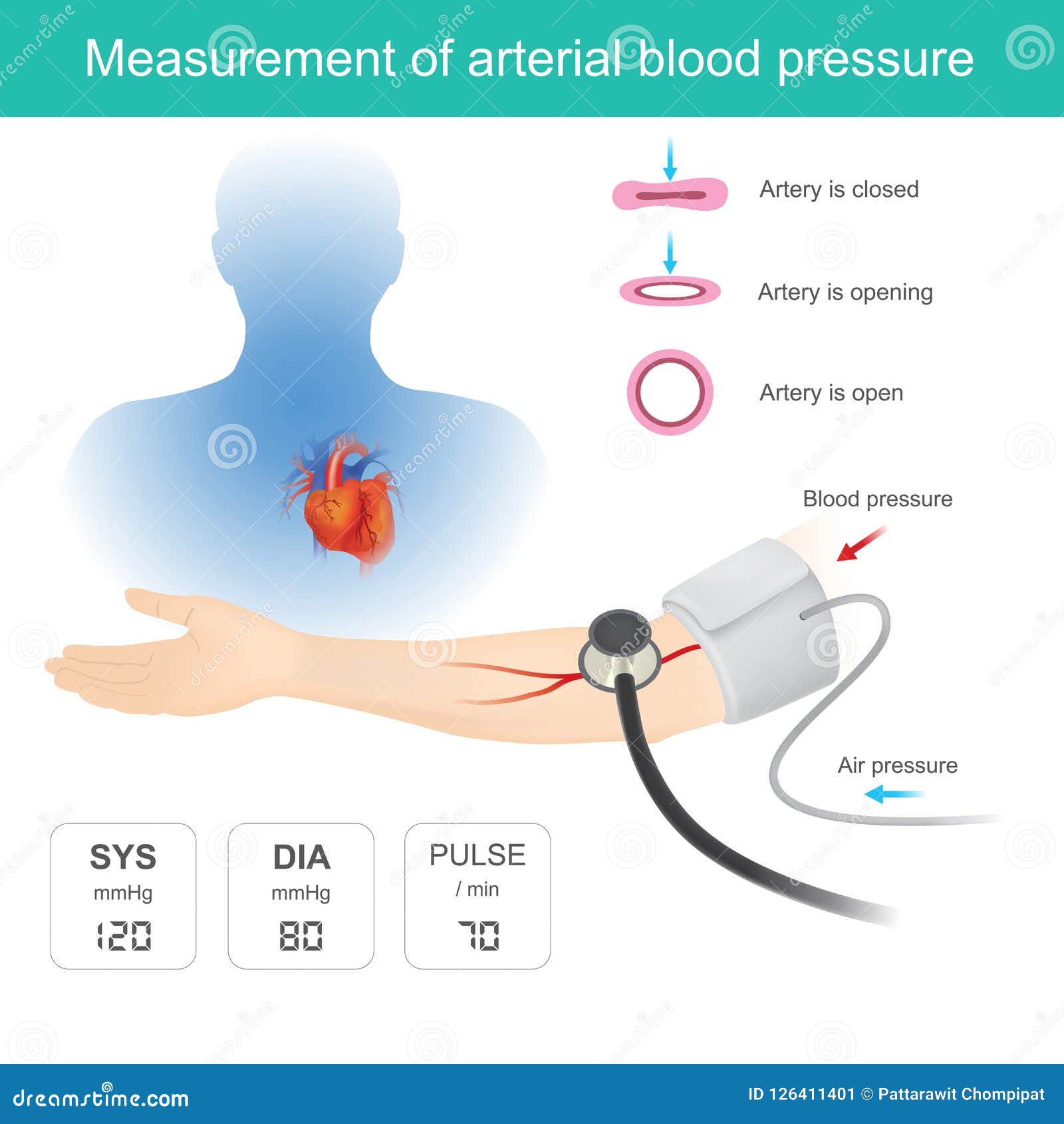 Misura Di Pressione Sanguigna Arteriosa Illustrazione Vettoriale ...
