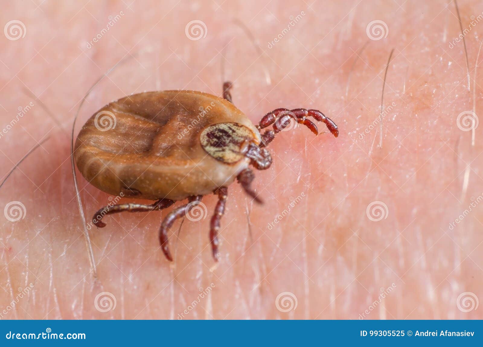 Mite crawls on human skin stock image. Image of close - 99305525