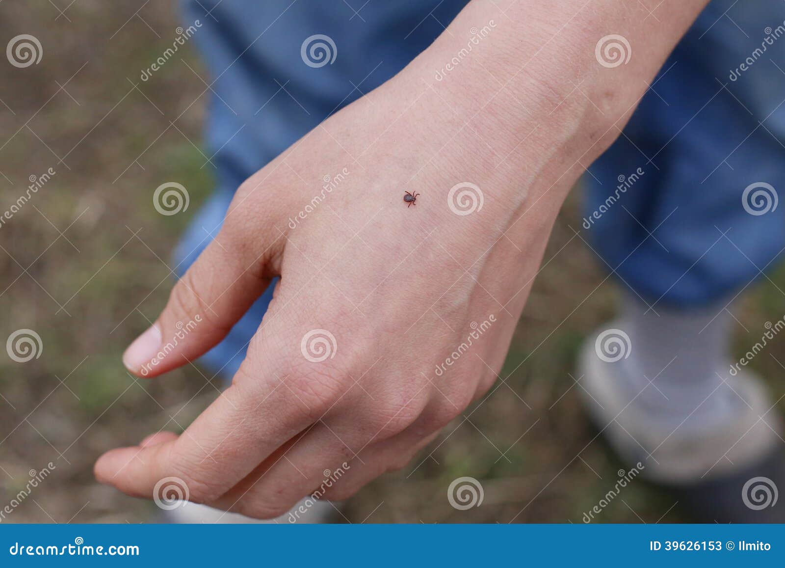 Mite stock image. Image of bite, encephalitis, ease, pest - 39626153