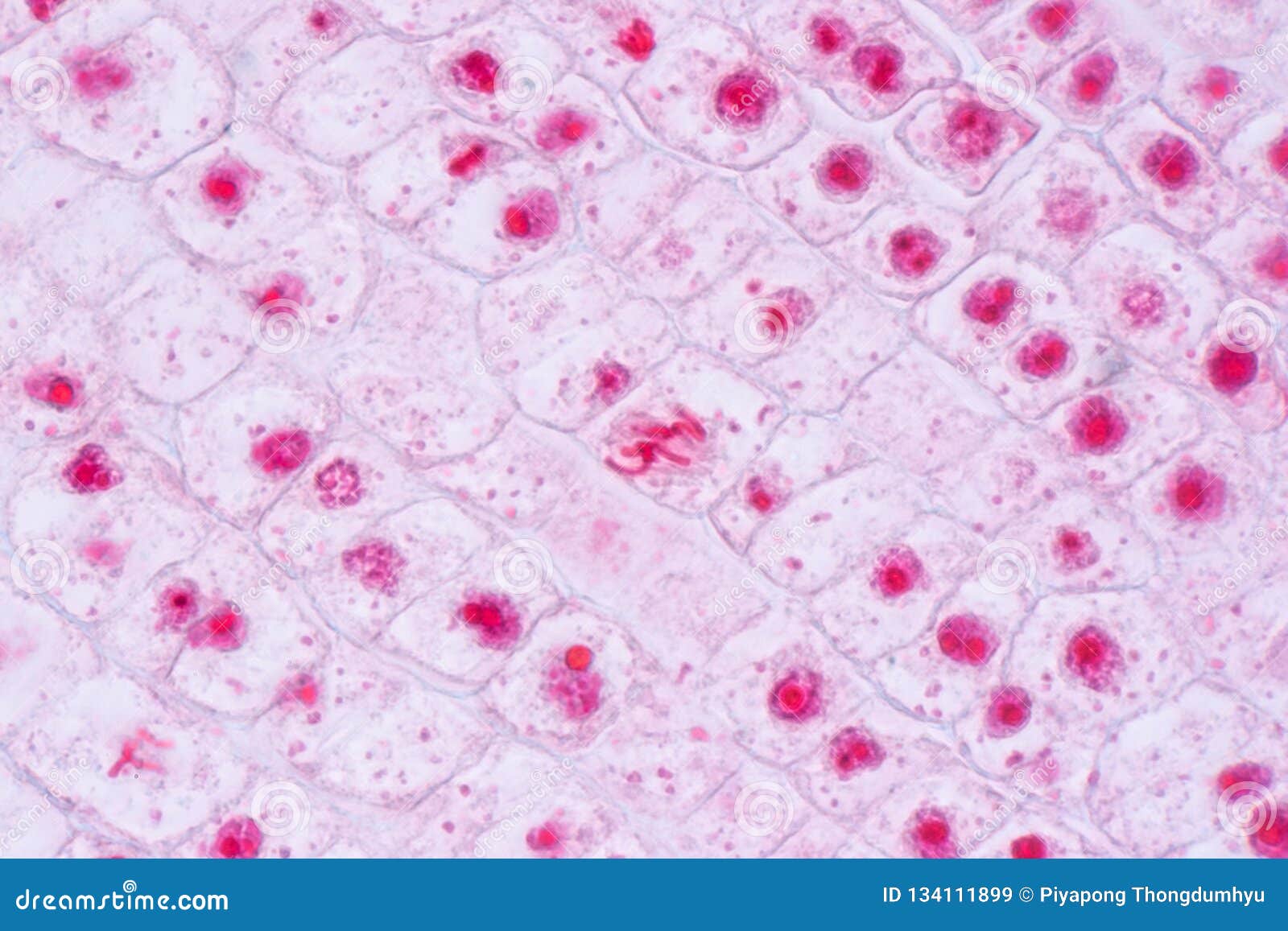 Mitosecel in Het Worteluiteinde Van Ui Onder Een Microscoop Stock ...