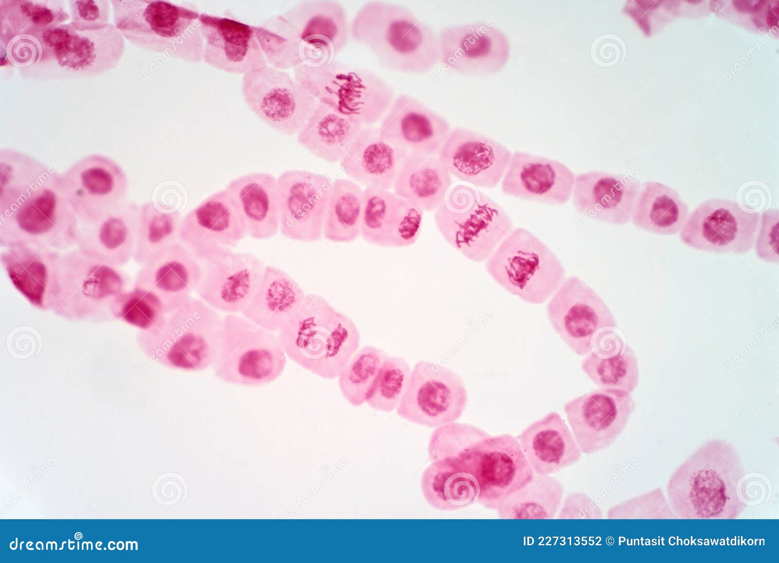 Mitosis Cell of Root Tip of Onion Under the Light Microscope Stock ...