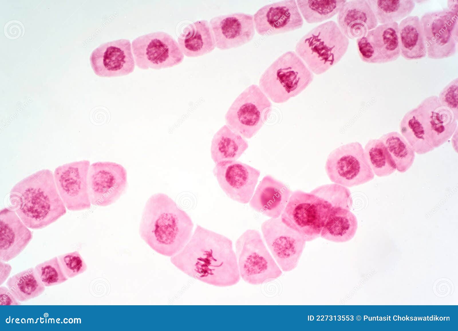 Mitosis Cell In The Root Tip Of Onion Under A Microscope. Stock Image ...