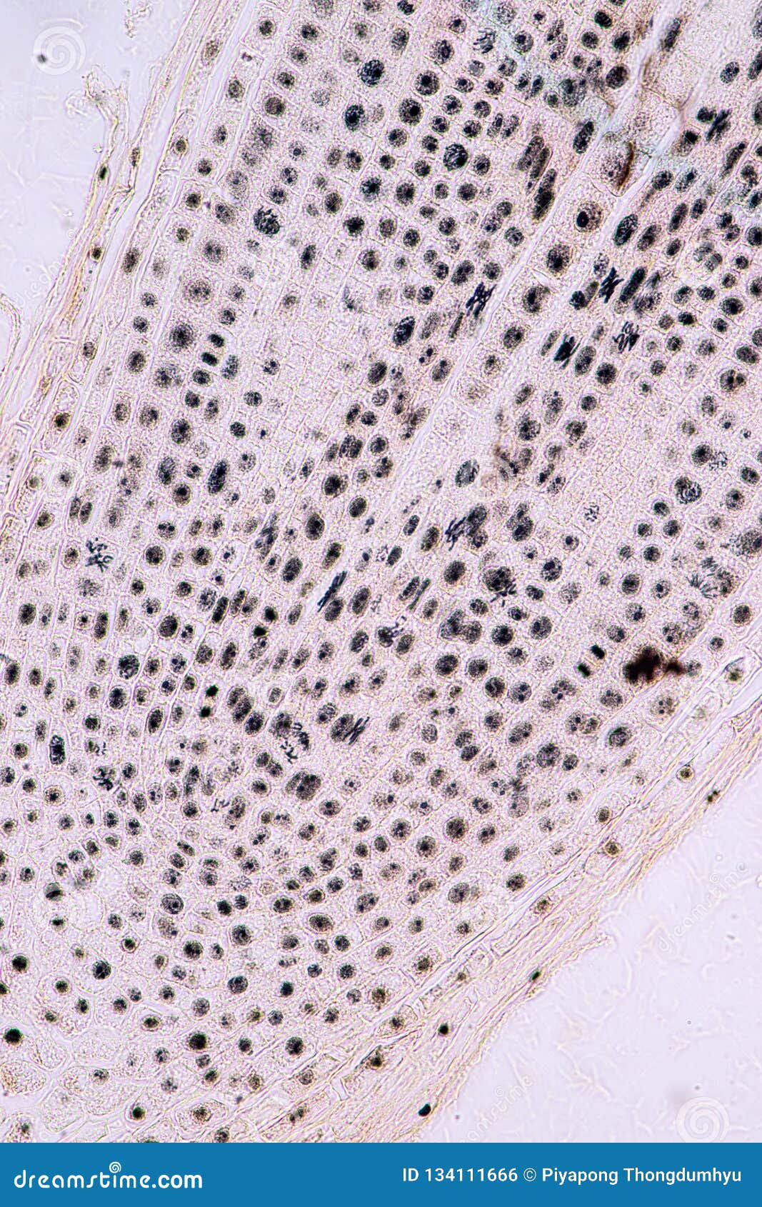 Mitosis Cell in the Root Tip of Onion Under a Microscope. Stock Photo ...