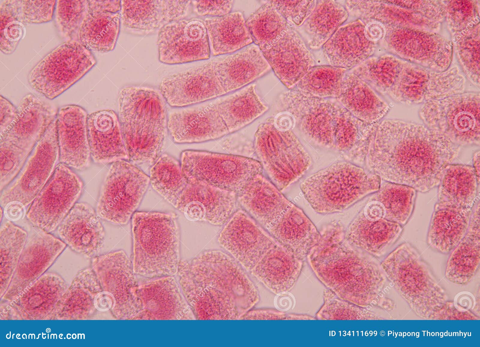 Mitosis Cell in the Root Tip of Onion Under a Microscope. Stock Image ...