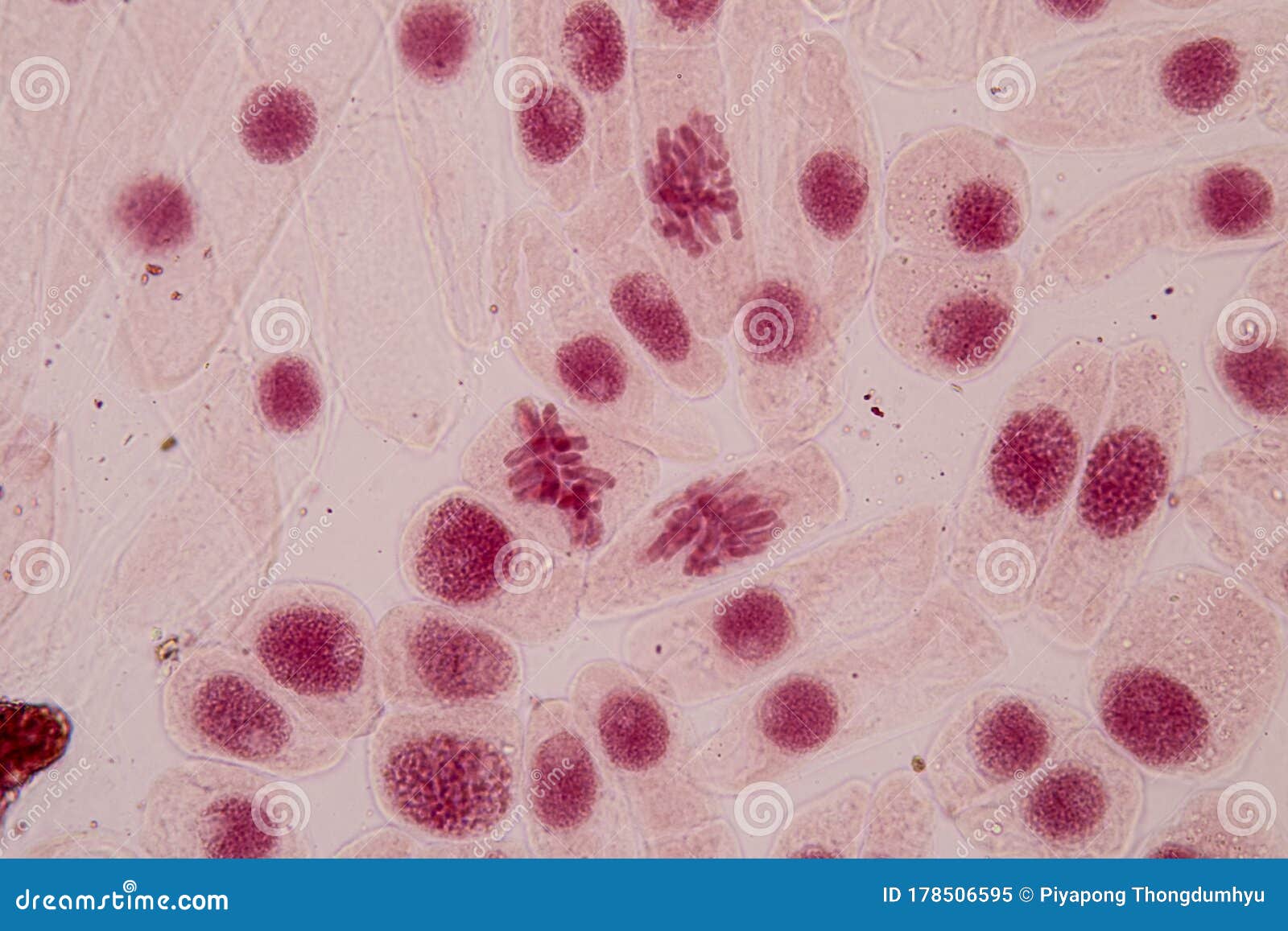 Mitosis Cell in the Root Tip of Onion Under a Microscope. Stock Image ...