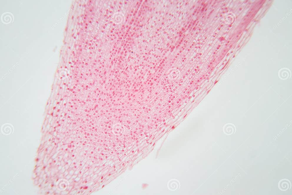 Mitosis Cell in the Root Tip of Onion Under a Microscope. Stock Photo ...
