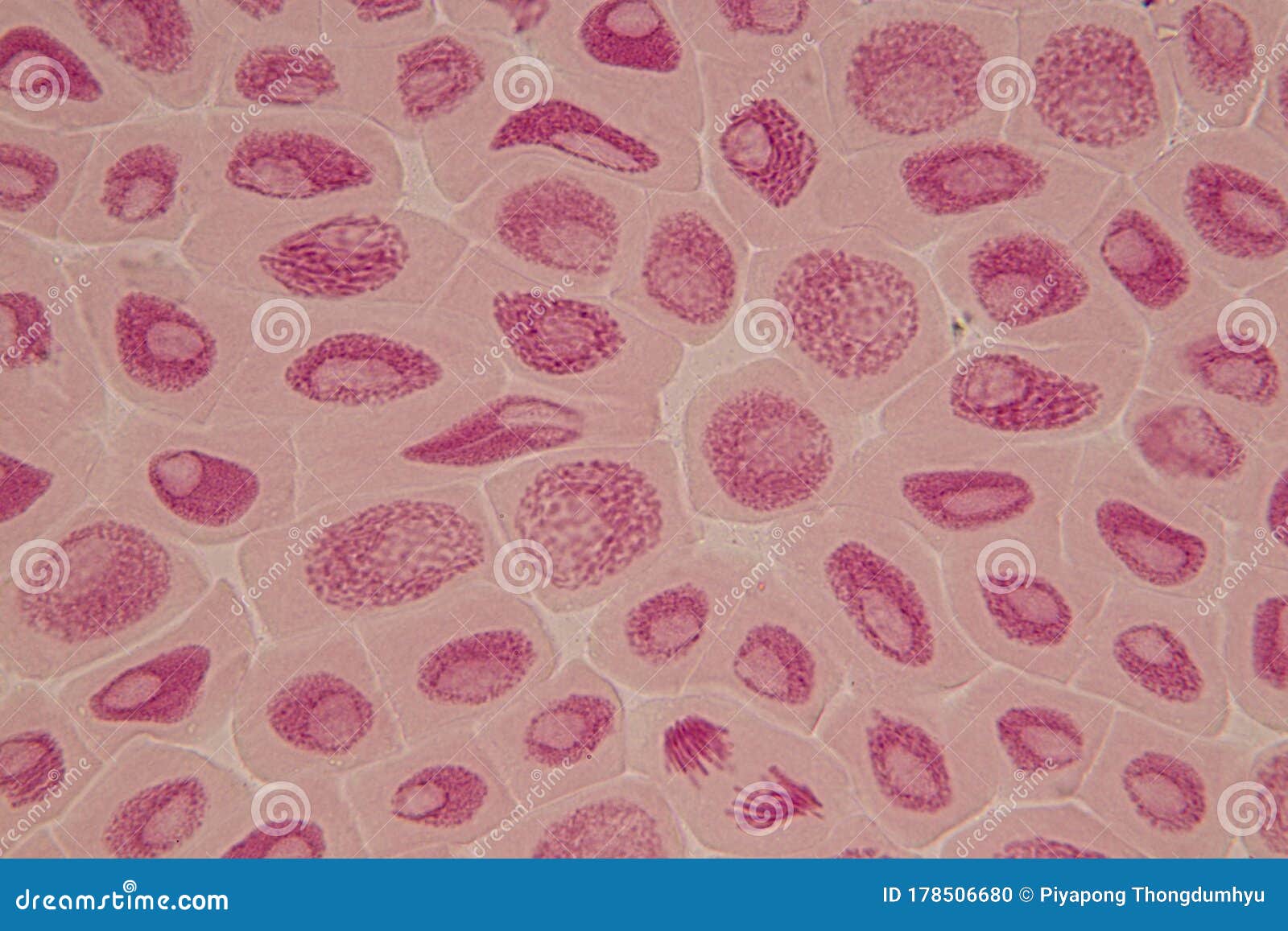 Mitosis Cell in the Root Tip of Onion Under a Microscope. Stock Photo ...