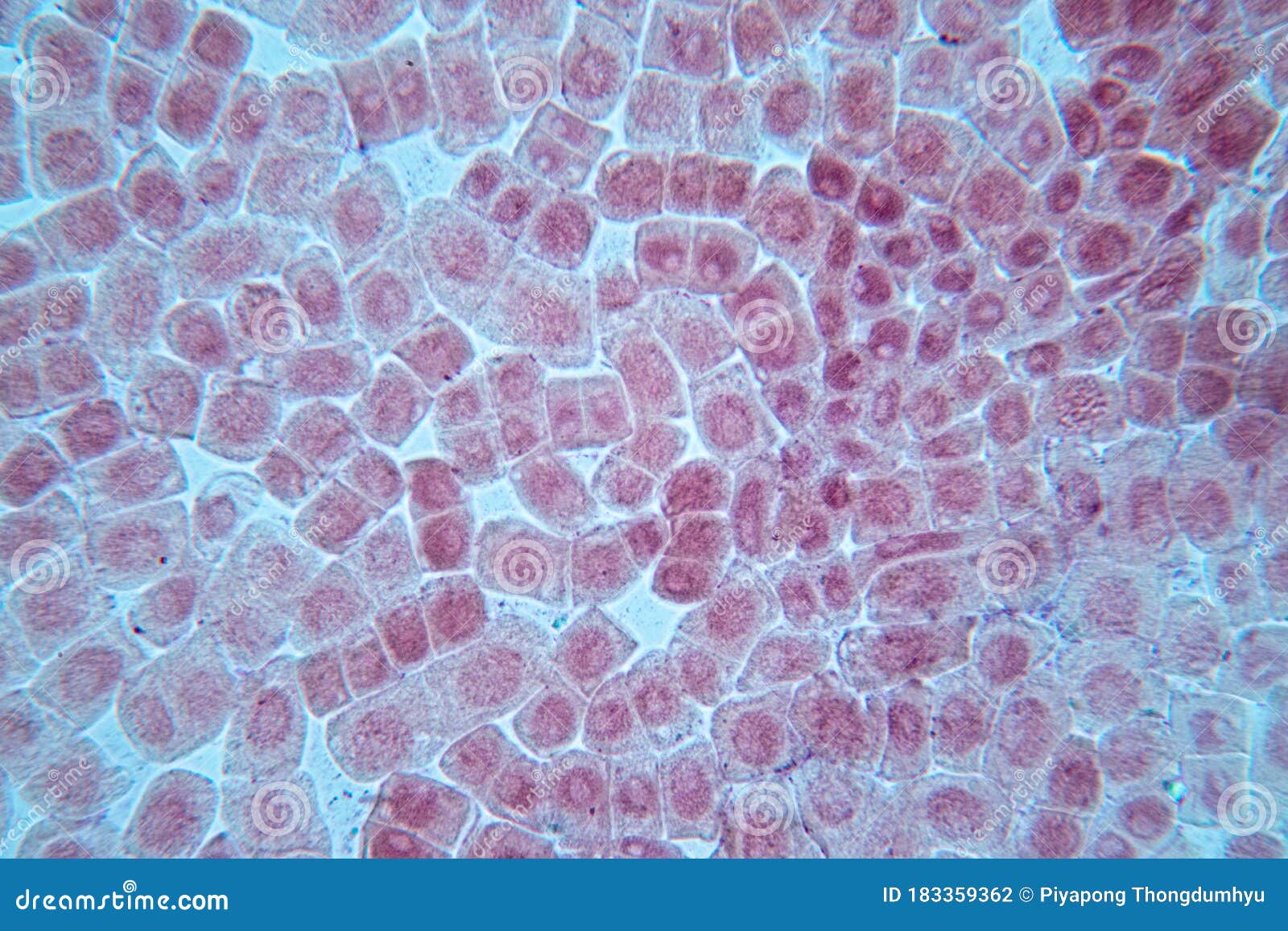 Mitosis Cell in the Root Tip of Onion Under a Microscope. Stock Photo ...