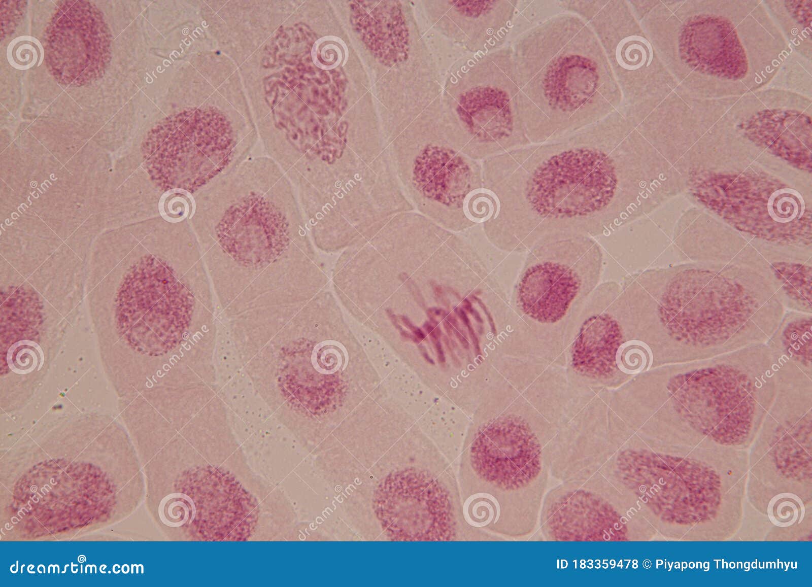 Mitosis Cell in the Root Tip of Onion Under a Microscope. Stock Photo ...