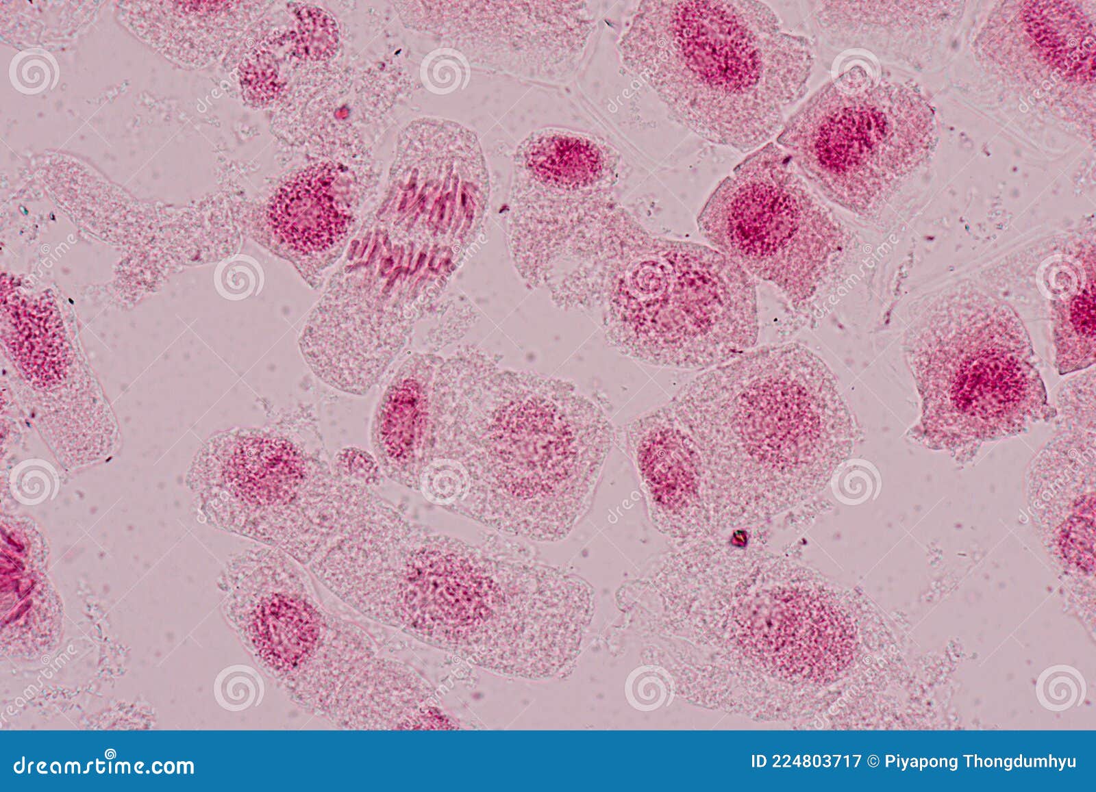 Mitosis Cell in the Root Tip of Onion Under a Microscope. Stock Image ...