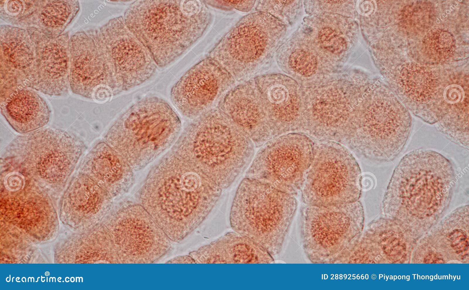 Mitosis Cell in the Root Tip of Onion Under a Microscope. Stock Photo ...