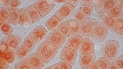 Mitosis Cell in the Root Tip of Onion Under a Microscope. Stock Photo ...