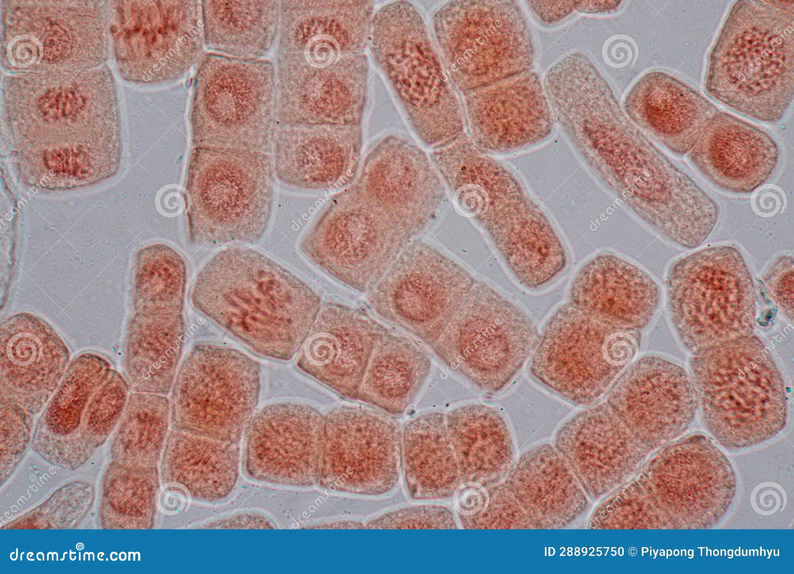 Mitosis Cell in the Root Tip of Onion Under a Microscope. Stock Photo ...