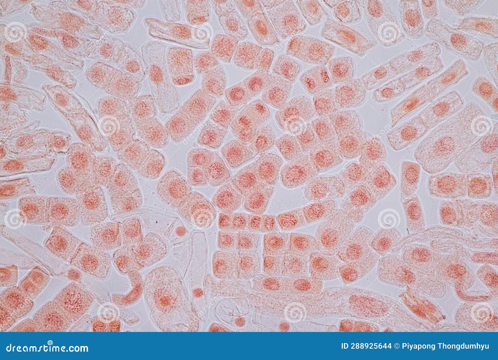 Mitosis Cell in the Root Tip of Onion Under a Microscope. Stock Photo ...