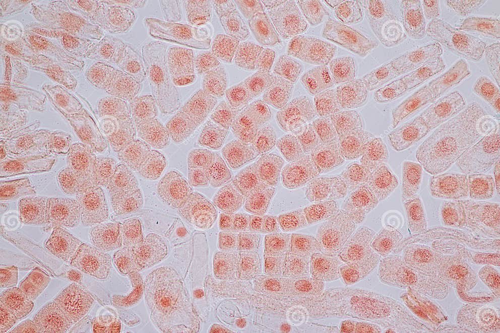 Mitosis Cell in the Root Tip of Onion Under a Microscope. Stock Photo ...