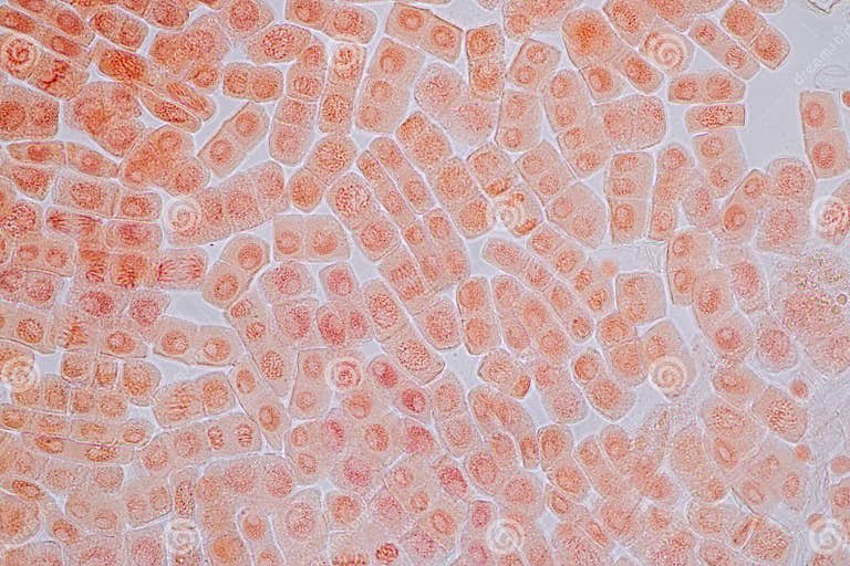 Mitosis Cell in the Root Tip of Onion Under a Microscope. Stock Photo ...