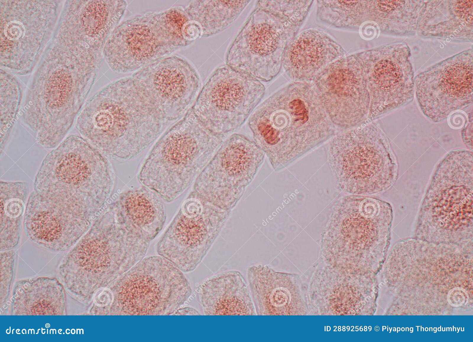 Mitosis Cell in the Root Tip of Onion Under a Microscope. Stock Image ...