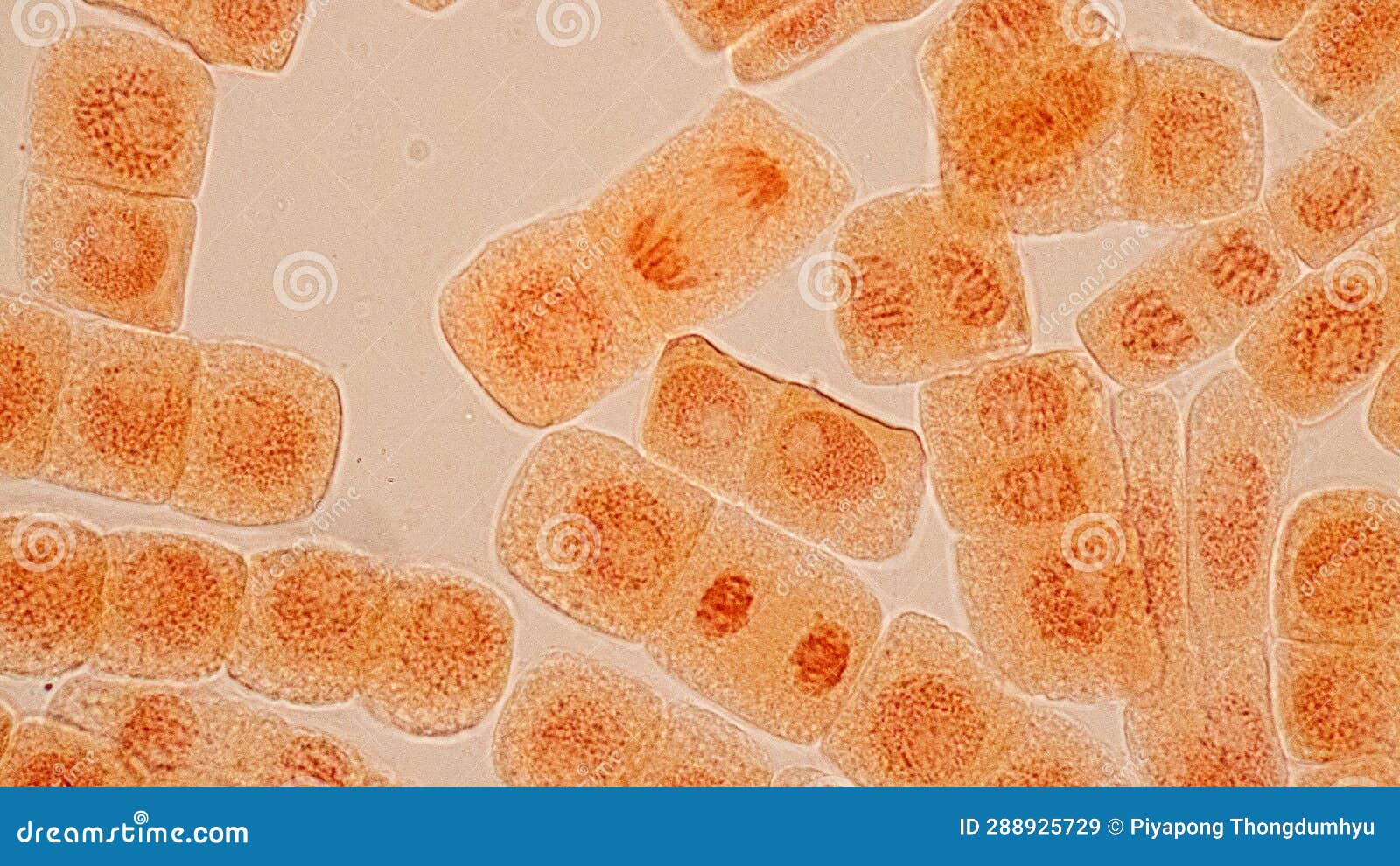 Mitosis Cell In The Root Tip Of Onion Under A Microscope. Stock Image ...
