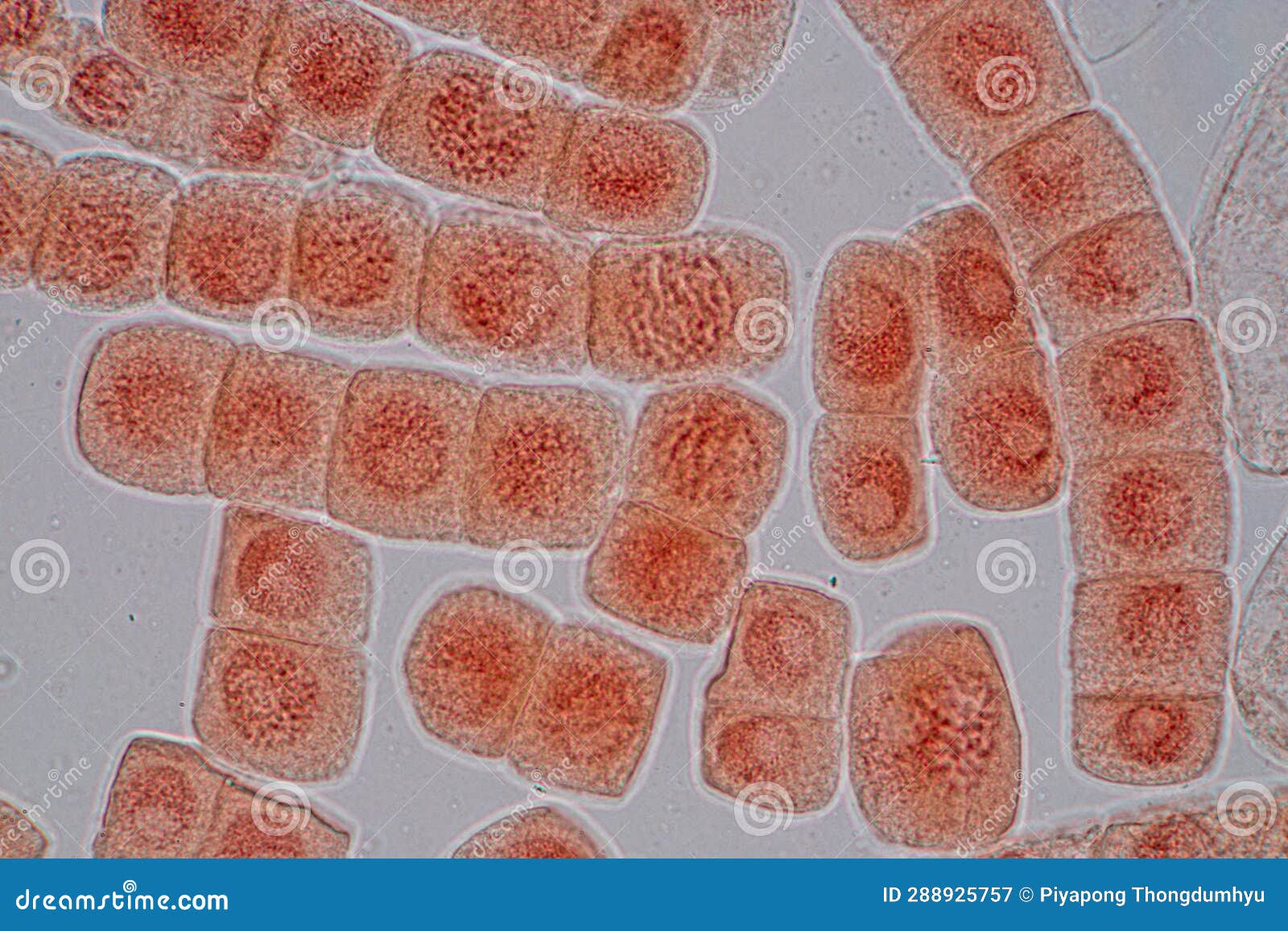 Mitosis Cell in the Root Tip of Onion Under a Microscope. Stock Image ...