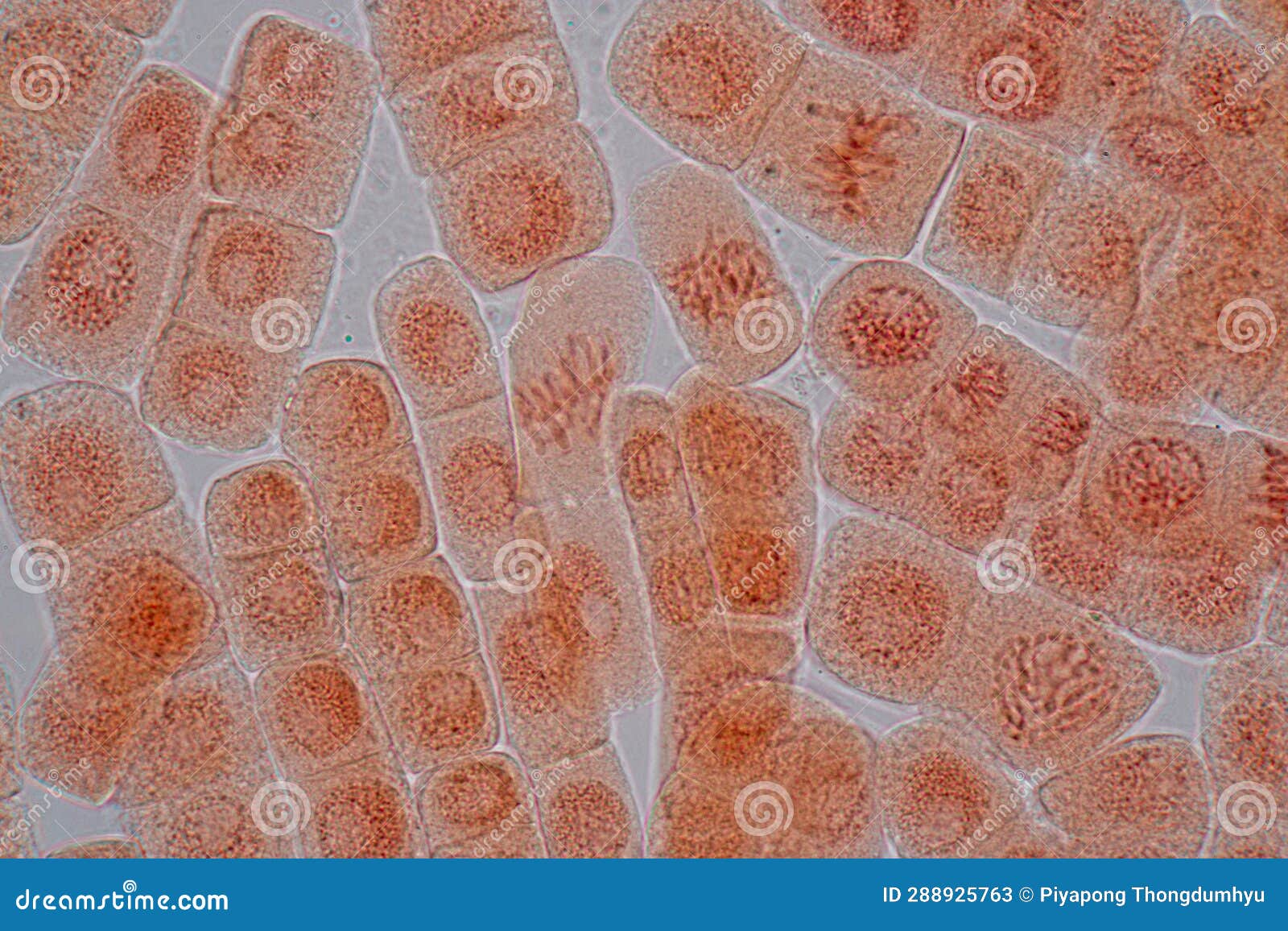 Mitosis Cell in the Root Tip of Onion Under a Microscope. Stock Image ...