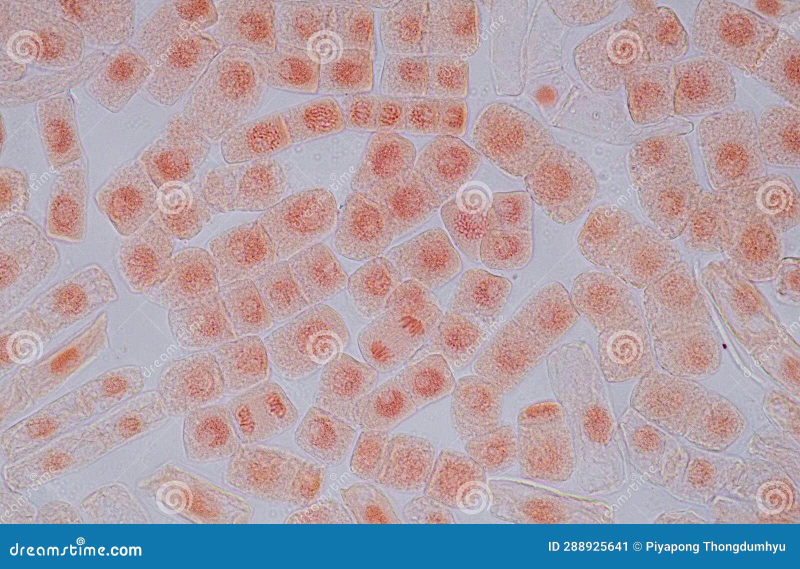 Mitosis Cell In The Root Tip Of Onion Under A Microscope. Royalty-Free ...