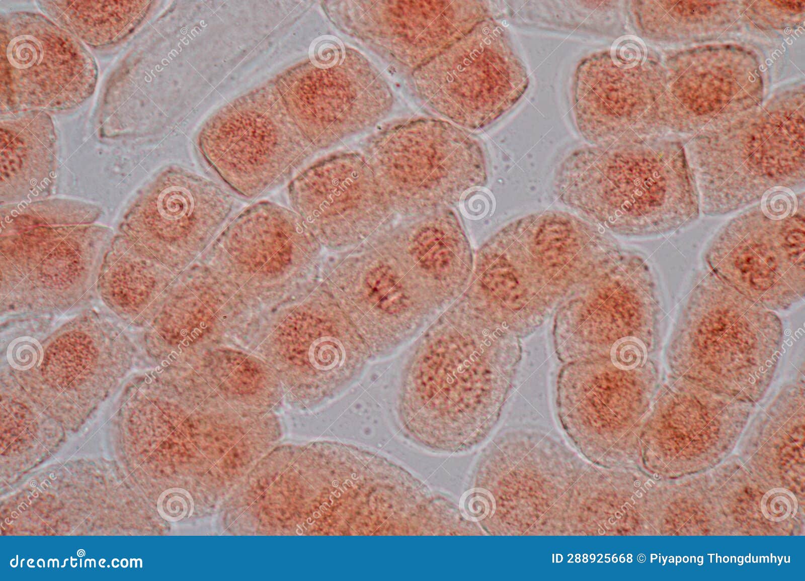 Mitosis Cell in the Root Tip of Onion Under a Microscope. Stock Photo ...