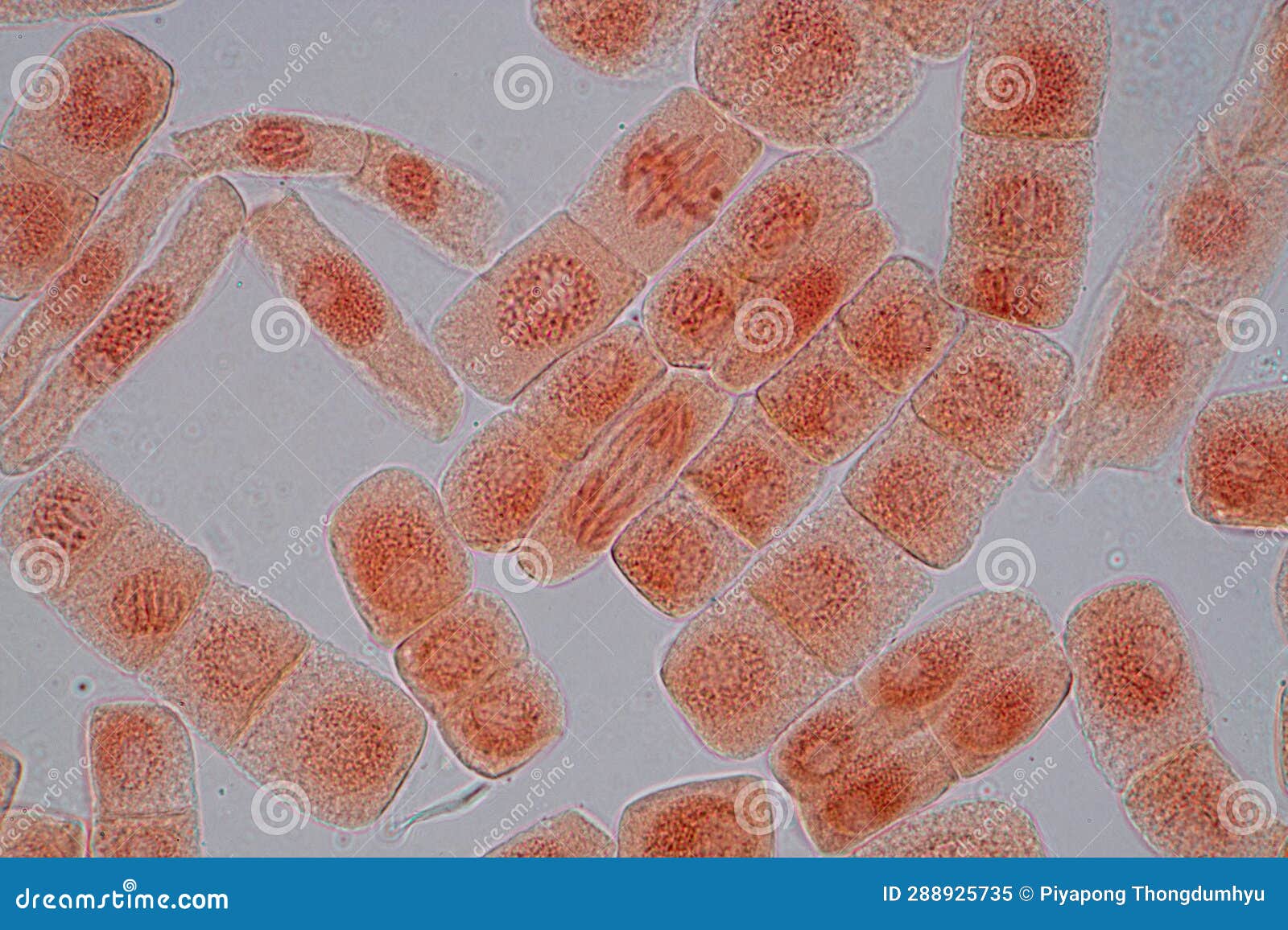 Mitosis Cell in the Root Tip of Onion Under a Microscope. Stock Image ...